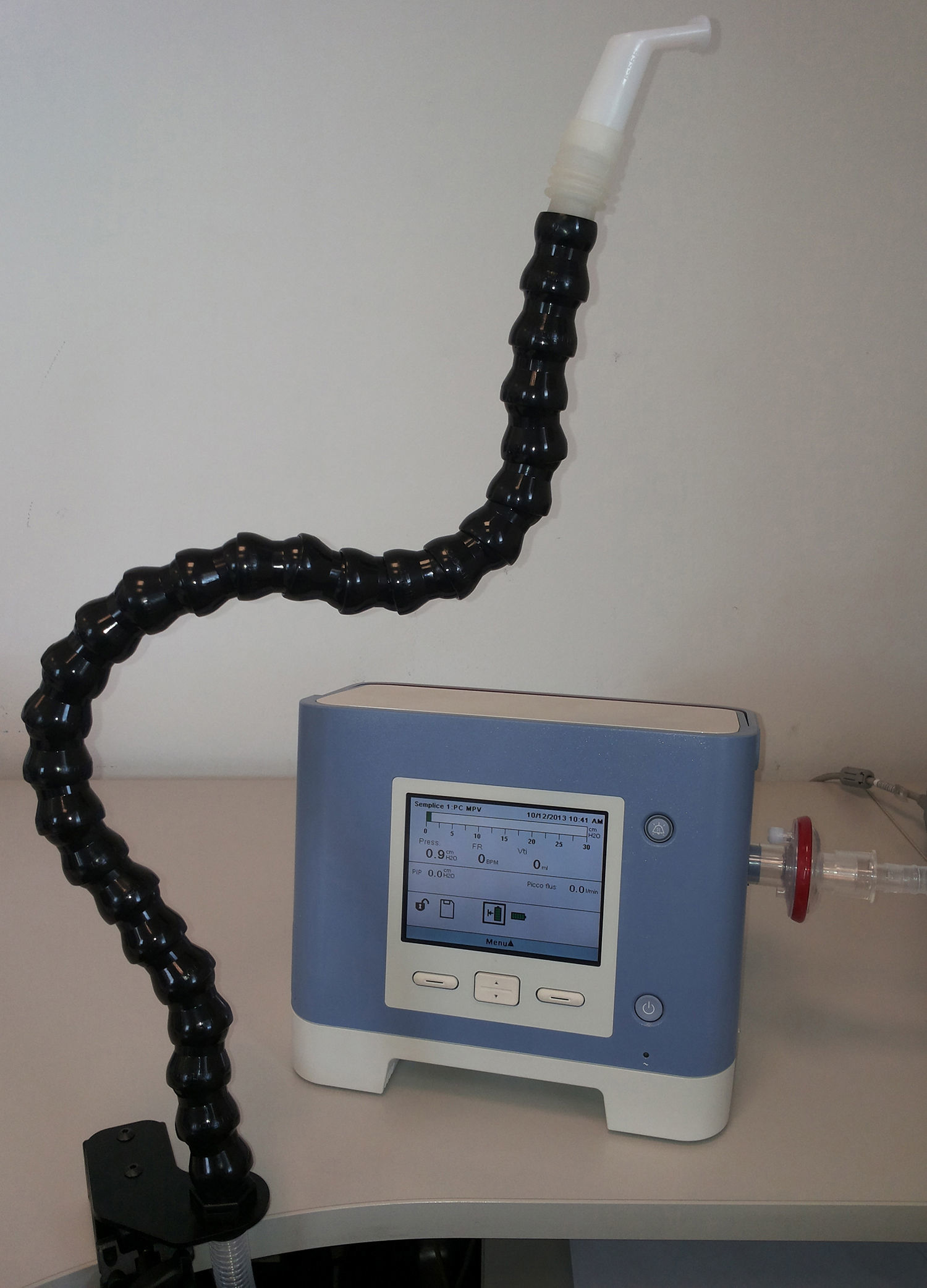 Open circuit mouthpiece ventilation: Concise clinical review | Pulmonology