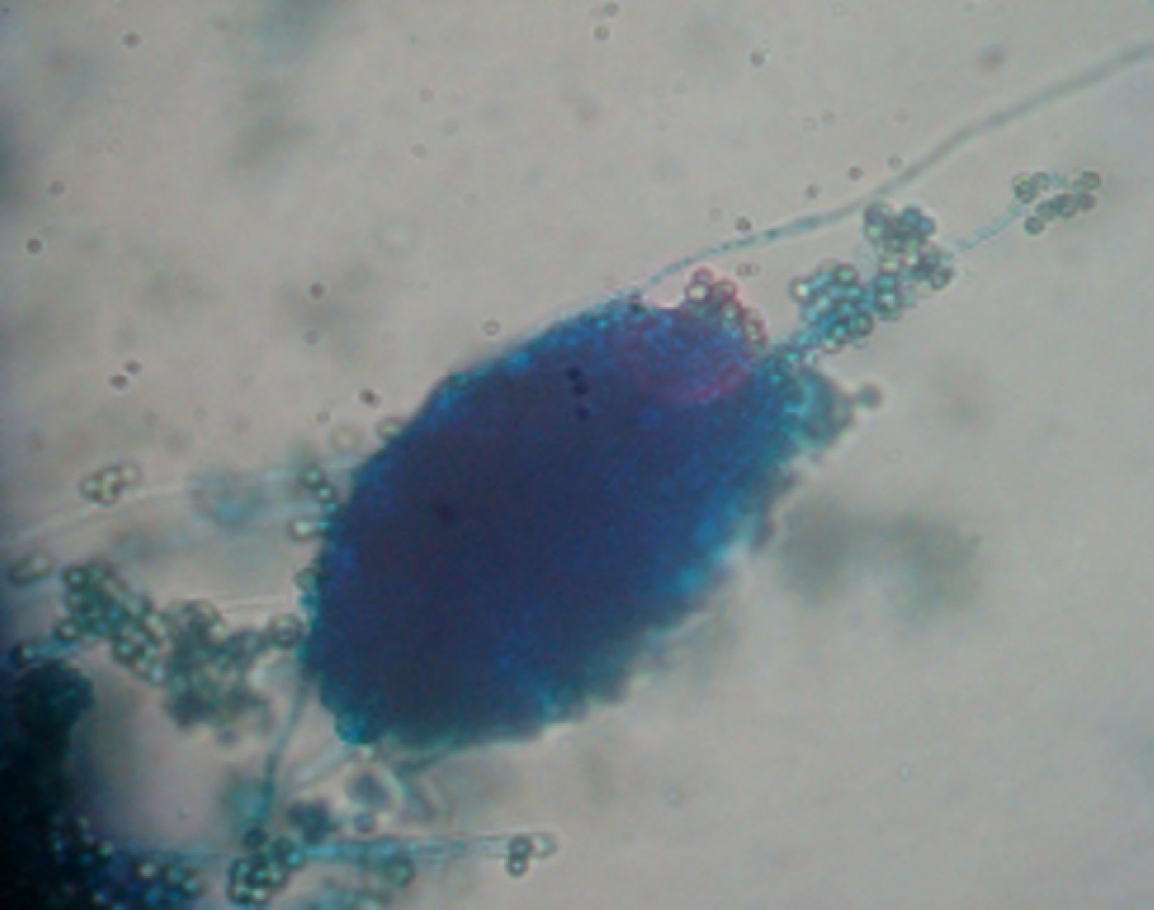 toxocara eggs under microscope