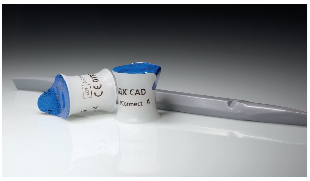 Recubrimiento digital de coronas y estructuras de puentes ...