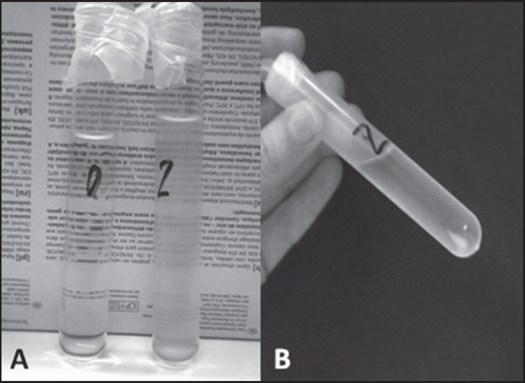Sequential intrapleural administration of fibrinolytic drugs and ...