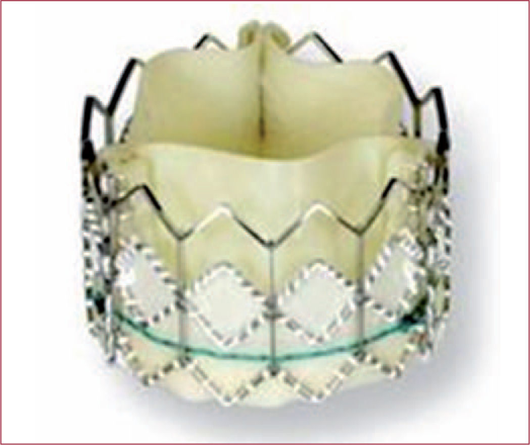¿Son iguales todas las prótesis? ¿Prótesis diferentes para indicaciones ...
