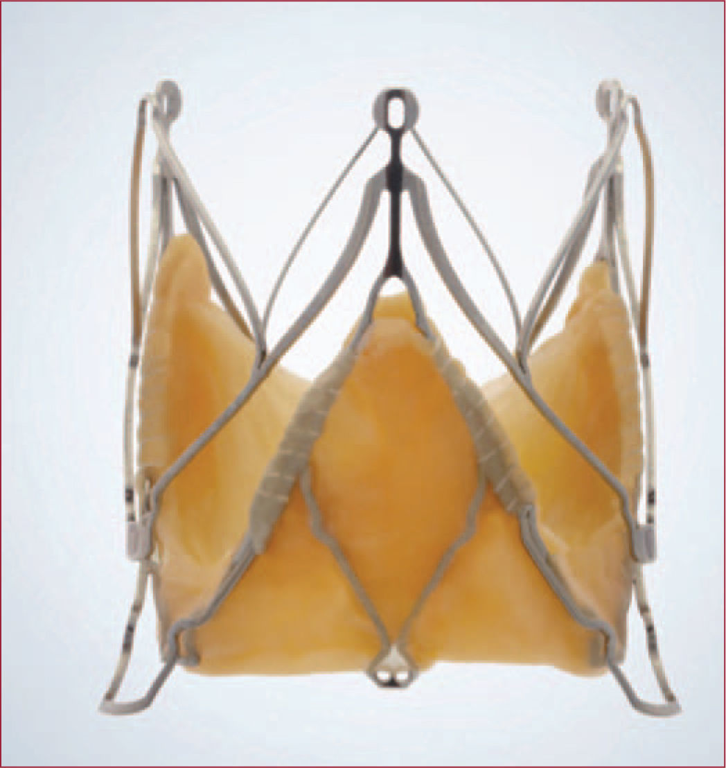 ¿Son iguales todas las prótesis? ¿Prótesis diferentes para indicaciones ...