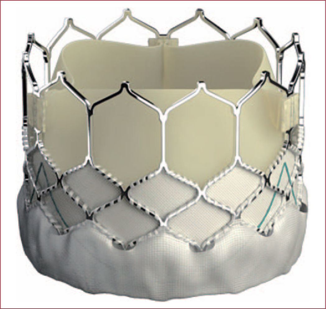 ¿Son iguales todas las prótesis? ¿Prótesis diferentes para indicaciones ...