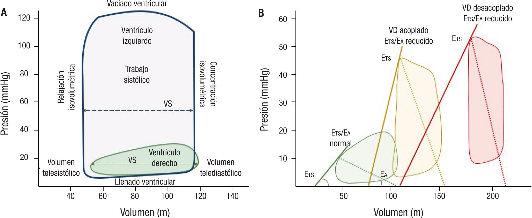 Disfunción ventricular derecha: ¿qué opciones tenemos? - Revista ...