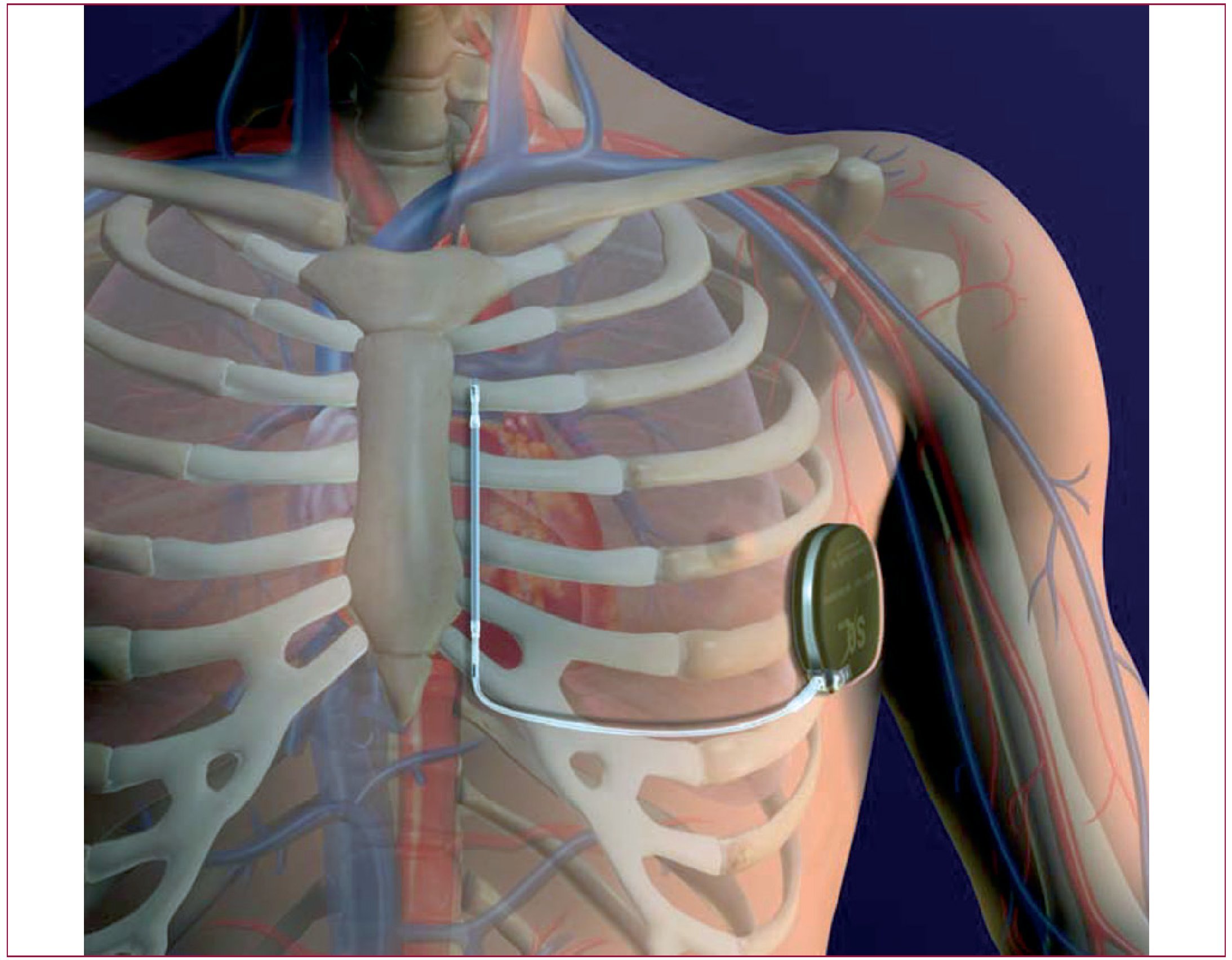 Novedades en electrofisiología cardiaca y arritmias | Revista Española ...