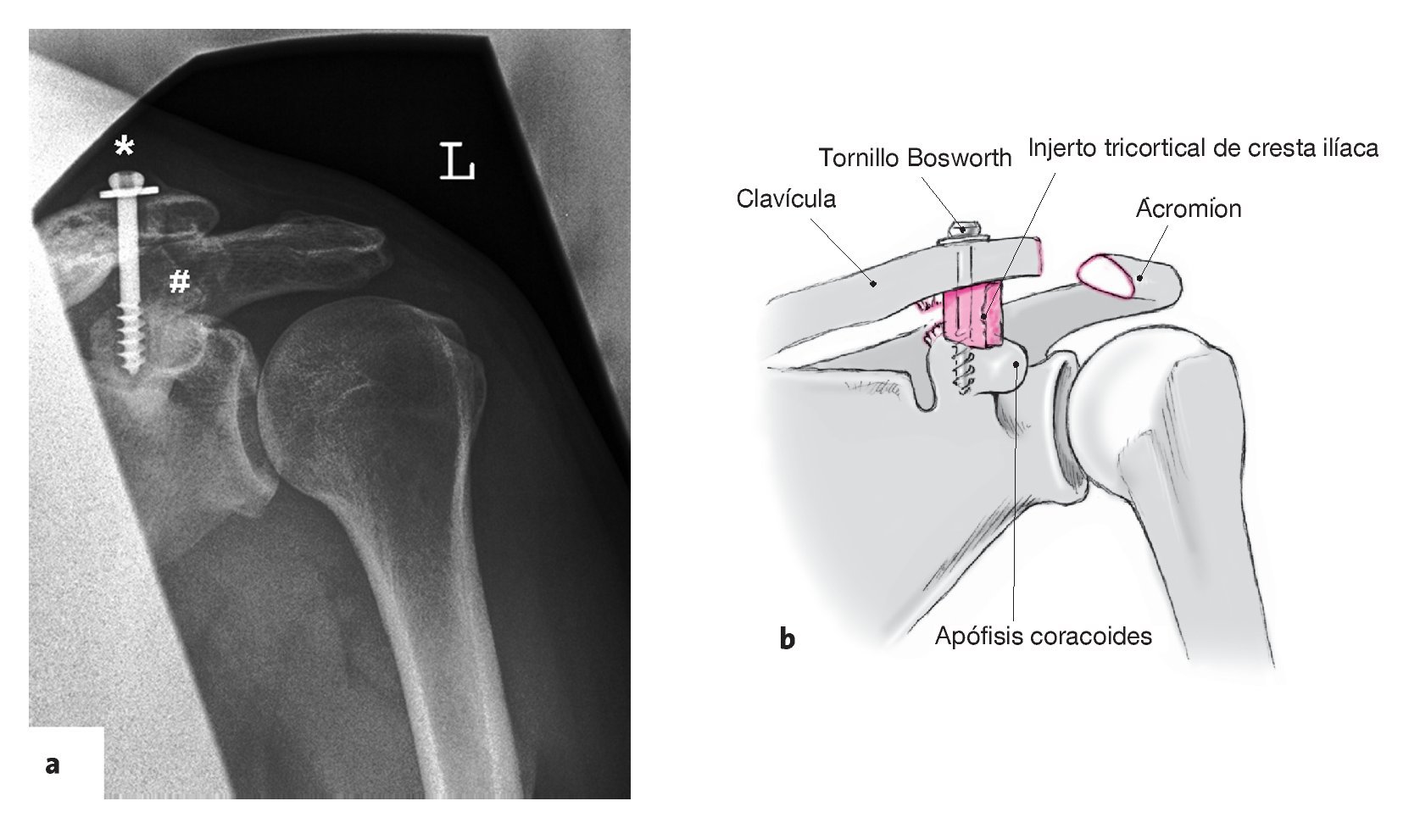 Problemática especial. Procedimiento para tratar un fracaso de la ...