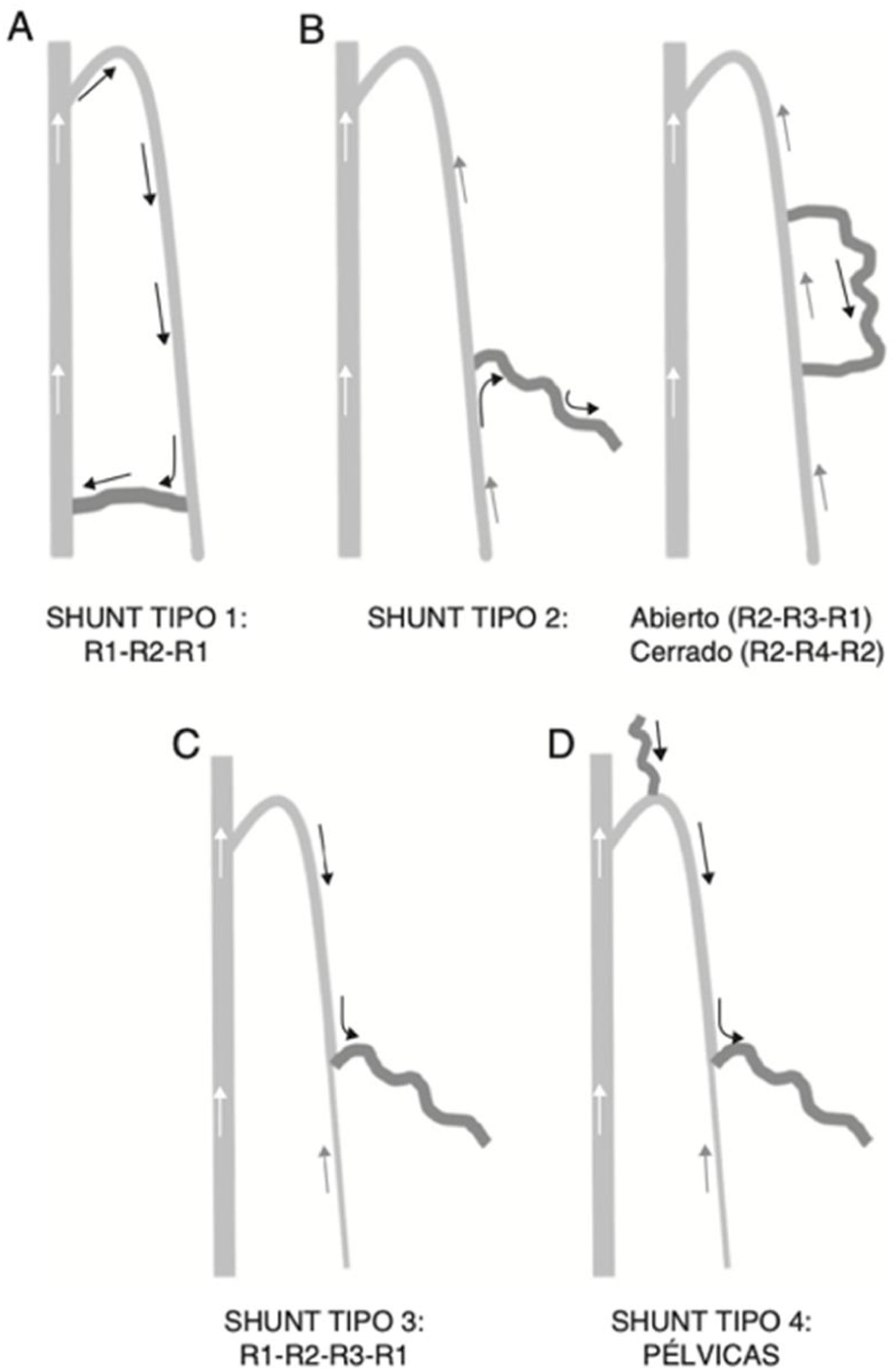 Estudio de la insuficiencia venosa crónica | Cirugía Cardiovascular