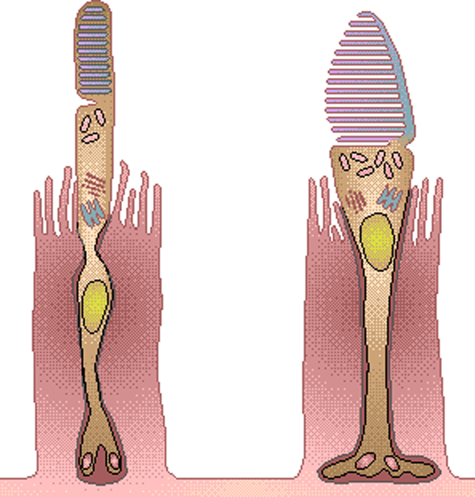 Un caso de eritropsia | Medicina de Familia. SEMERGEN