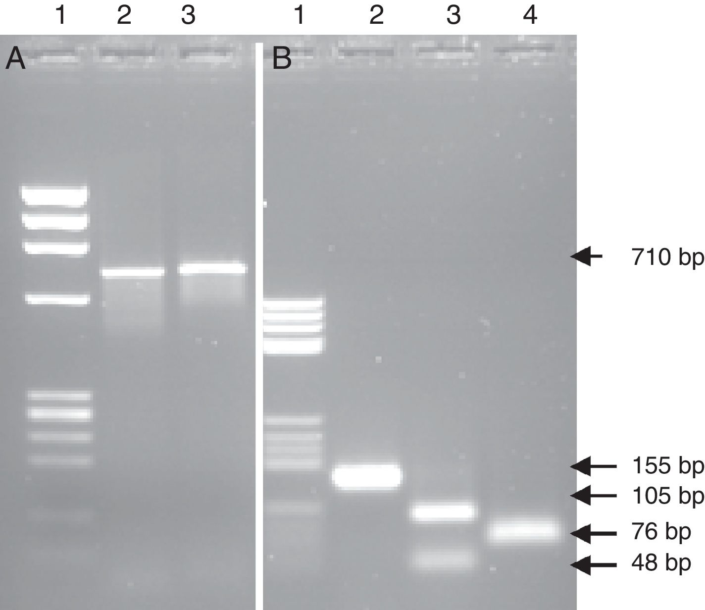 A broad-range PCR technique for the diagnosis of infective endocarditis ...