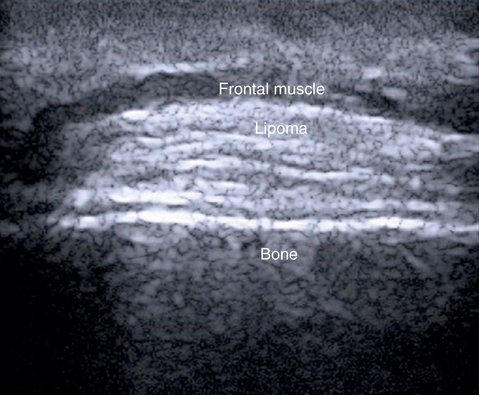 Ultrasound Skin Imaging | Actas Dermo-Sifiliográficas