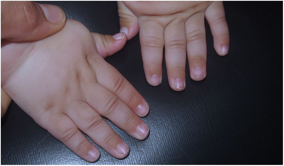 do babies have knuckles