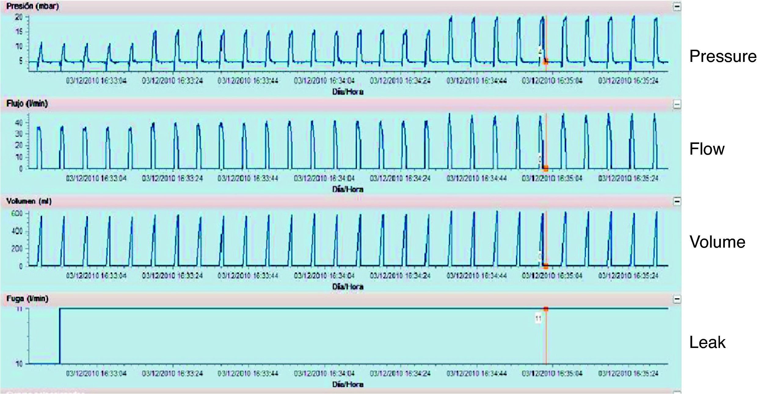 Home Mechanical Ventilation Monitoring Software: Measure More or ...