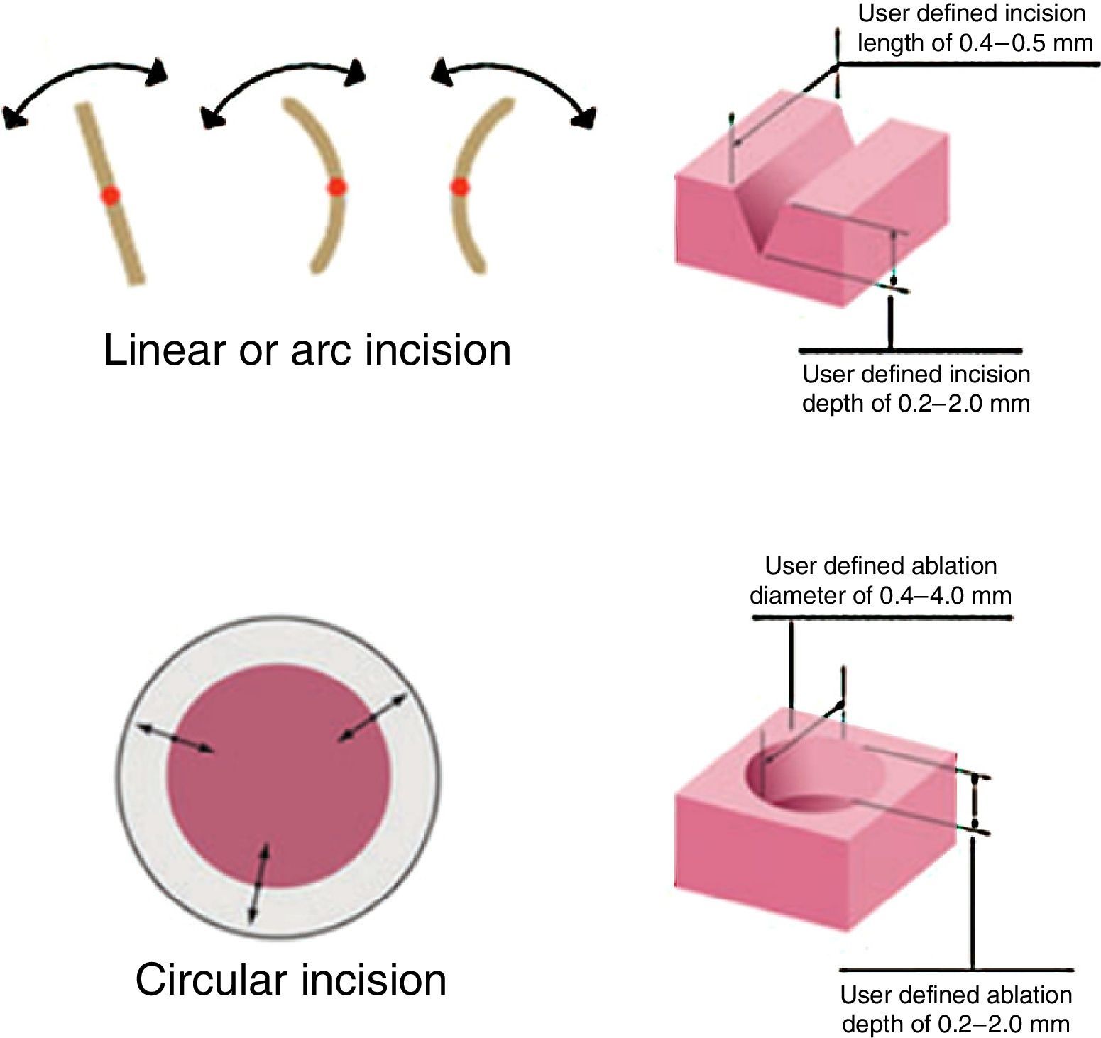 AcuBlade® Laser System: A New Tool for Interventional Bronchoscopist ...