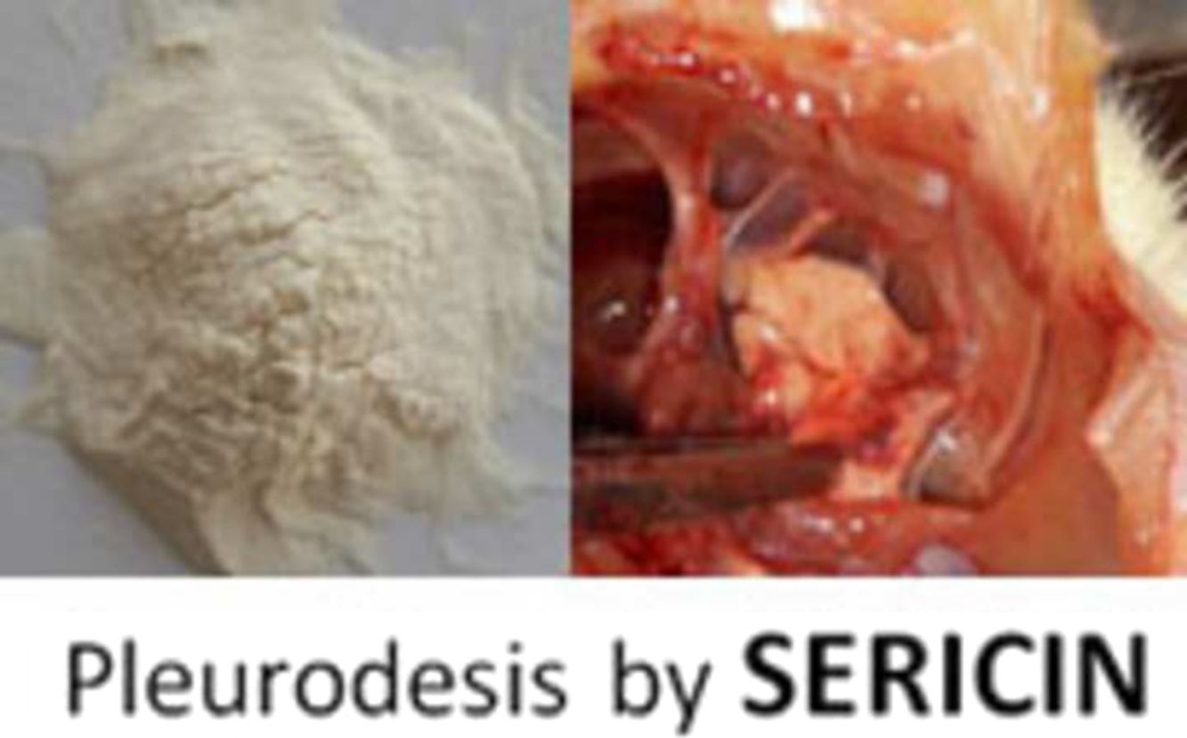 Does Sericin, as a Novel Pleurodesis Agent, Have Higher Effectiveness ...