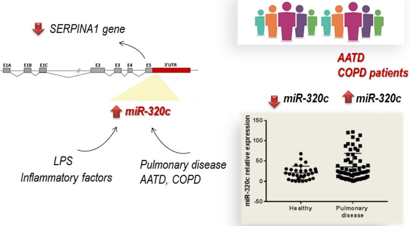 miR-320c Regulates SERPINA1 Expression and Is Induced in Patients With ...