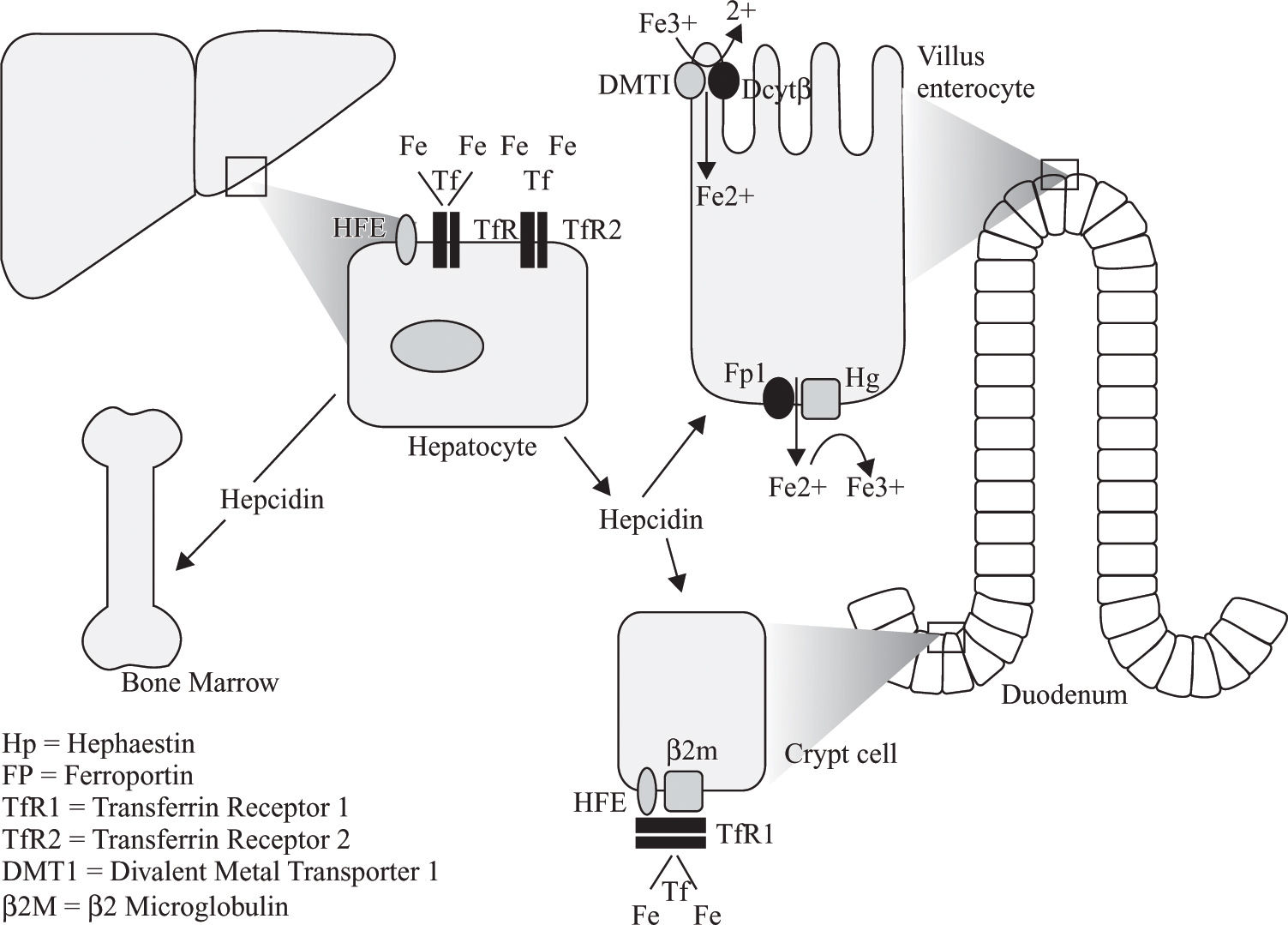 Hereditary Hemochromatosis: Genetics, Pathogenesis, and Clinical ...