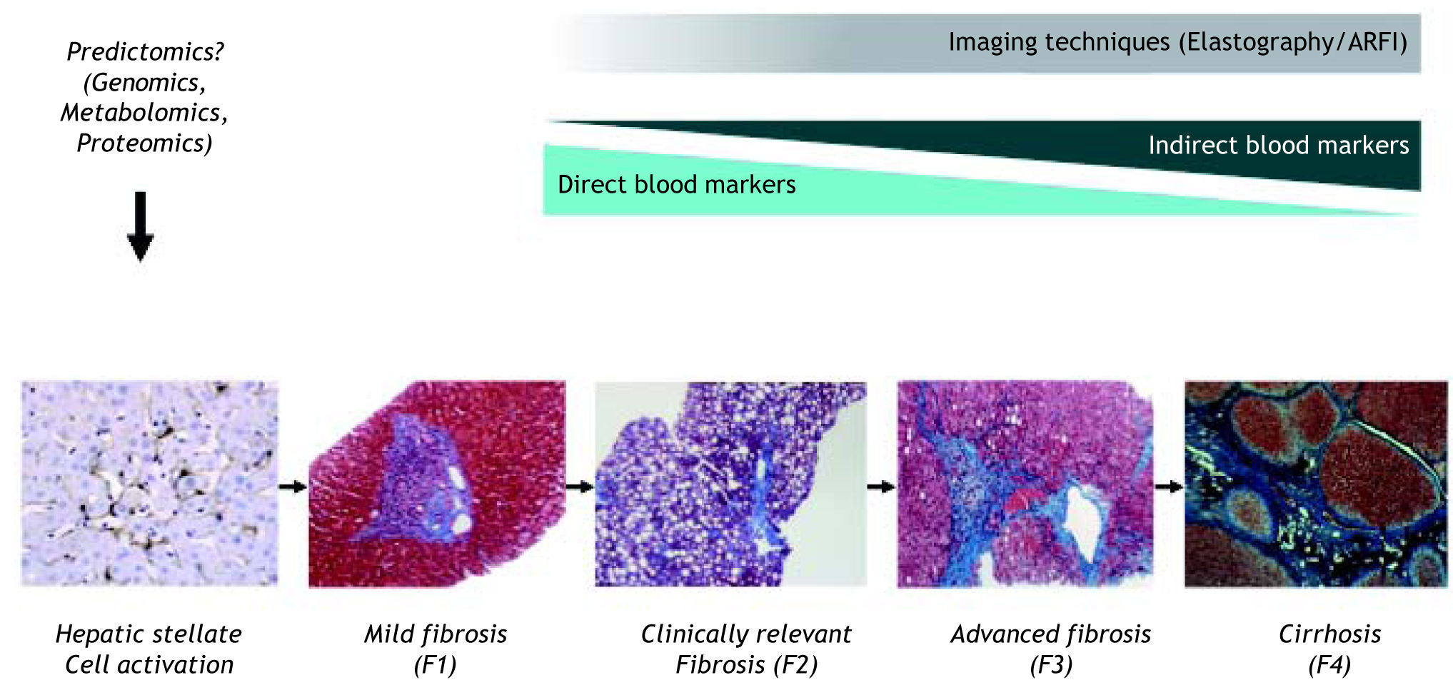 Noninvasive markers of fibrosis: key concepts for improving accuracy in ...