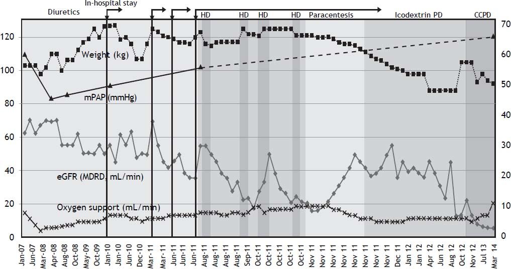 Peritoneal ultrafiltration for refractory fluid overload and ascites ...