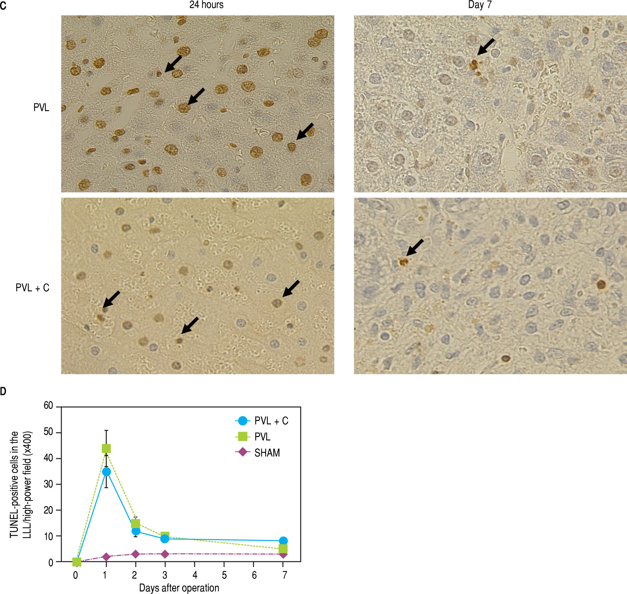 Effect of Portal Vein Ligation Plus Venous Congestion on Liver ...