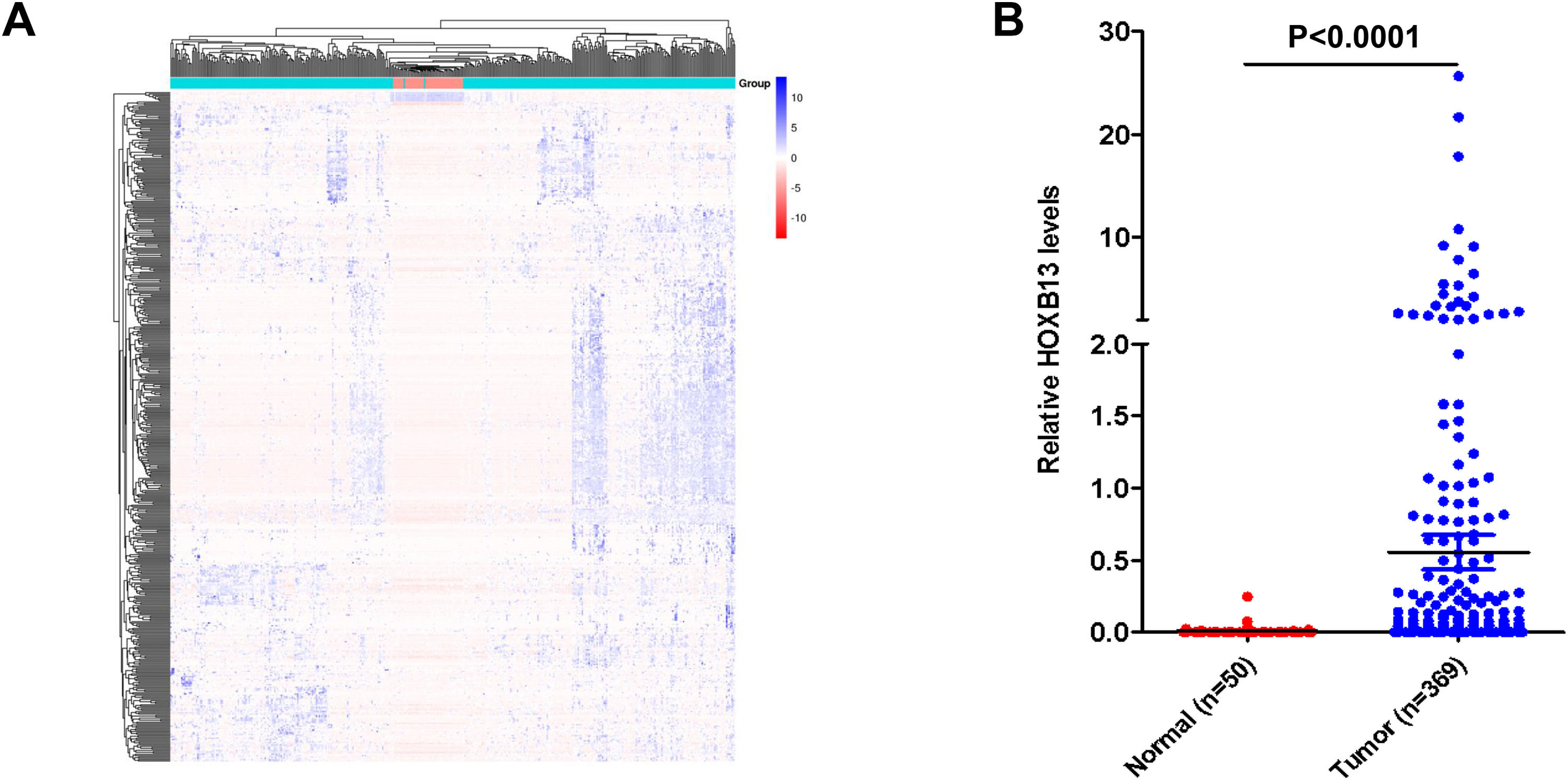 HOXB13 facilitates hepatocellular carcinoma progression by activating ...