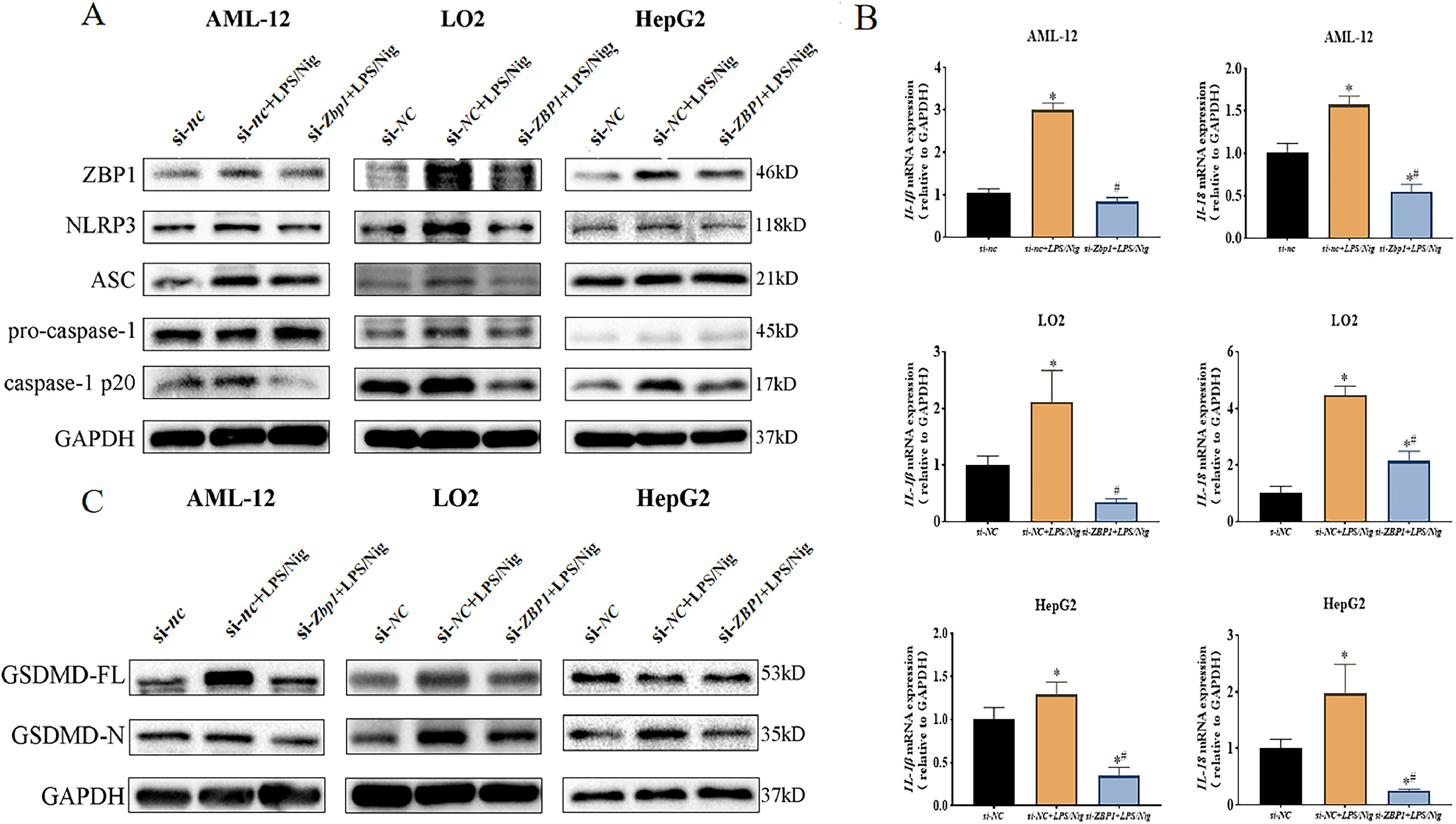 ZBP1 promotes hepatocyte pyroptosis in acute liver injury by regulating ...