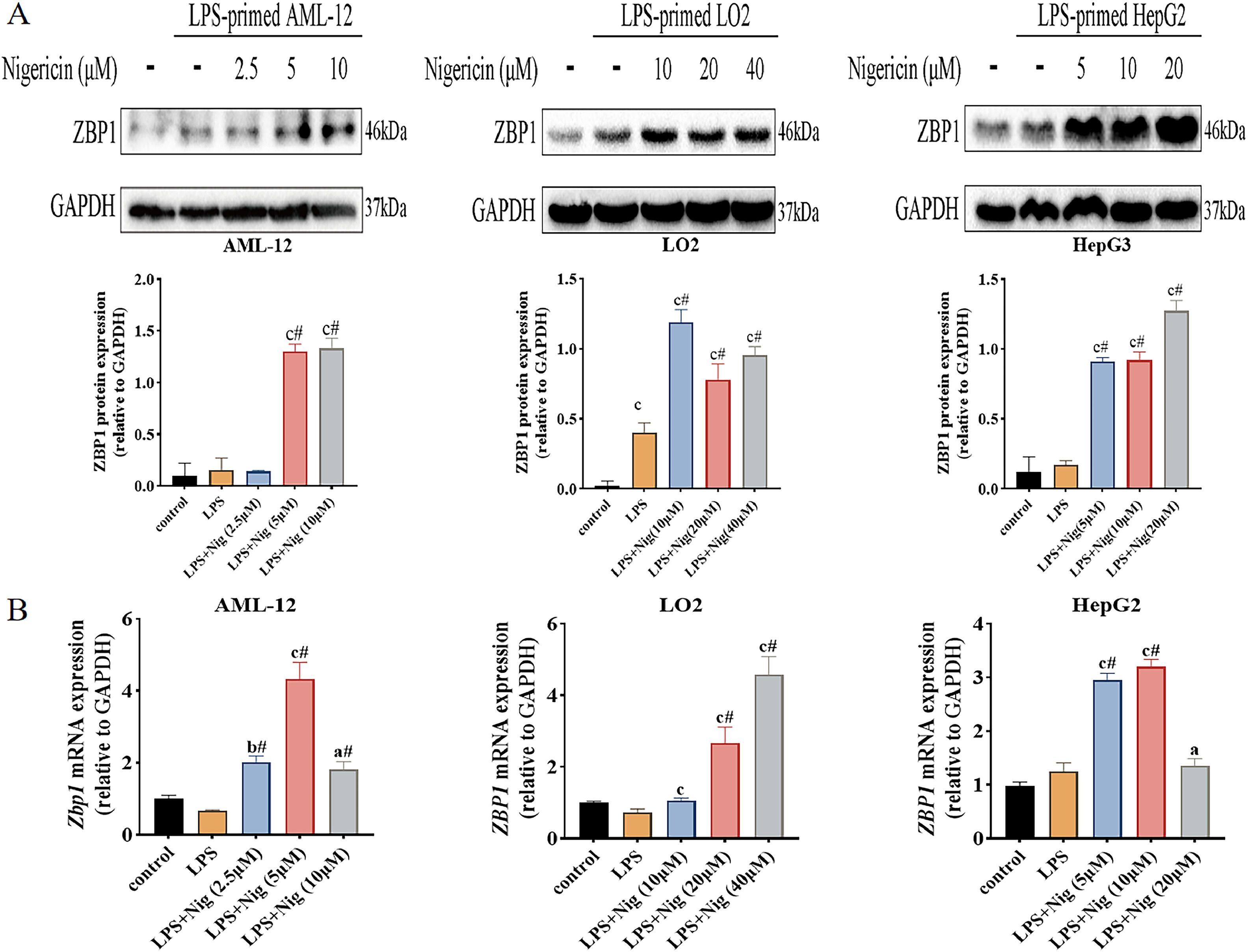 ZBP1 promotes hepatocyte pyroptosis in acute liver injury by regulating ...