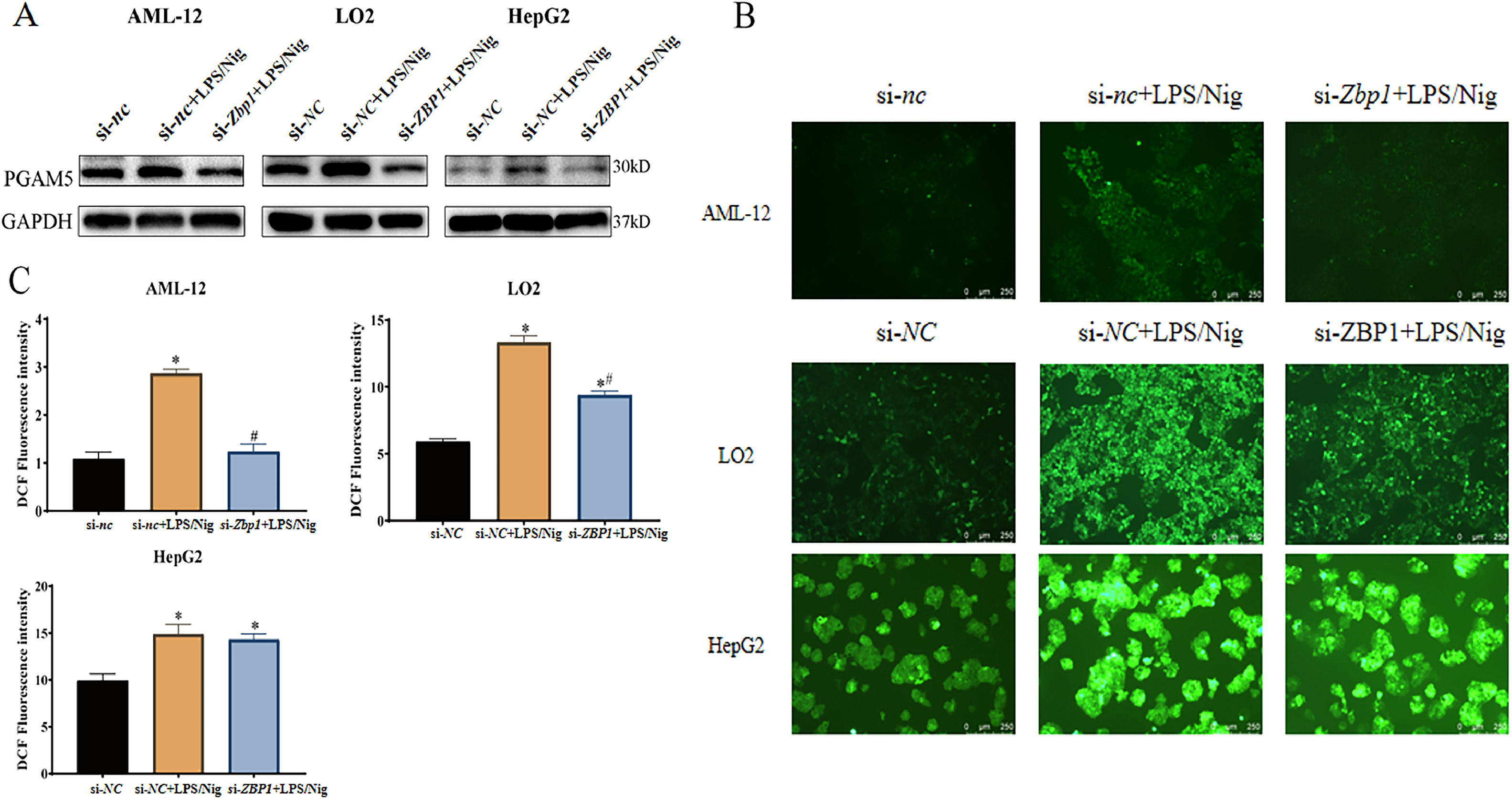 ZBP1 promotes hepatocyte pyroptosis in acute liver injury by regulating ...