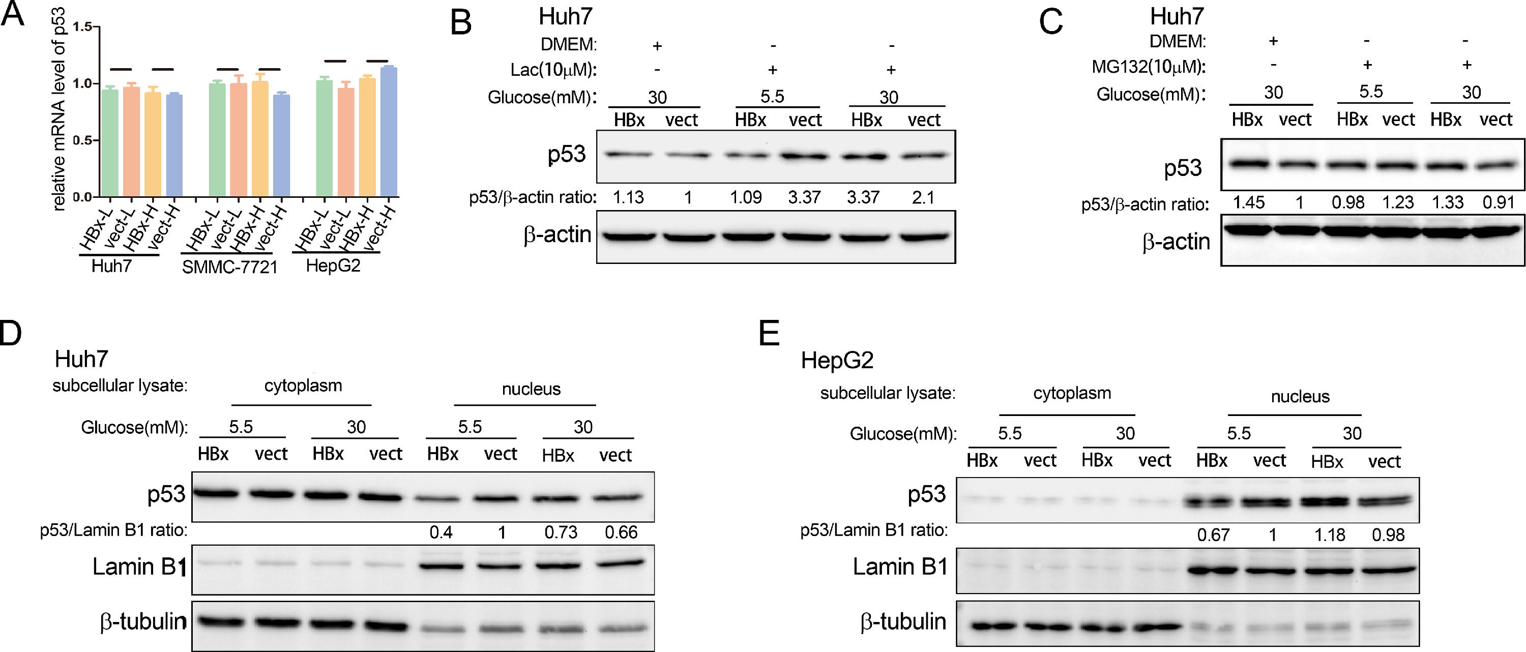 Hepatitis B virus X protein differentially regulates the angiogenesis ...