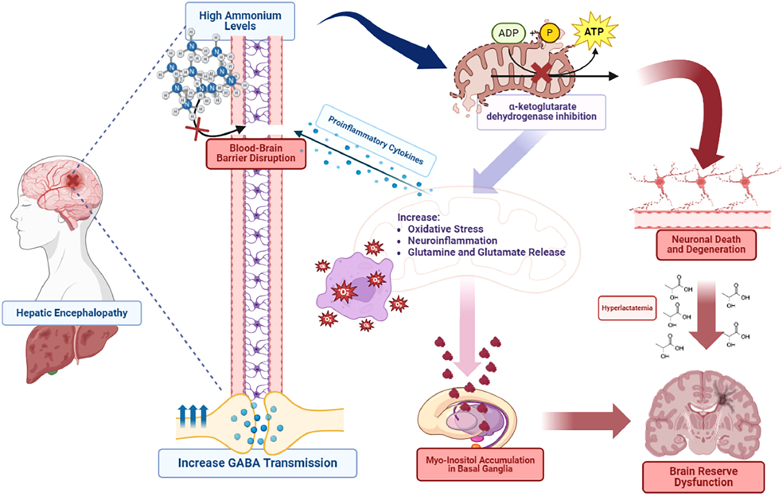 hepatic encephalopathy