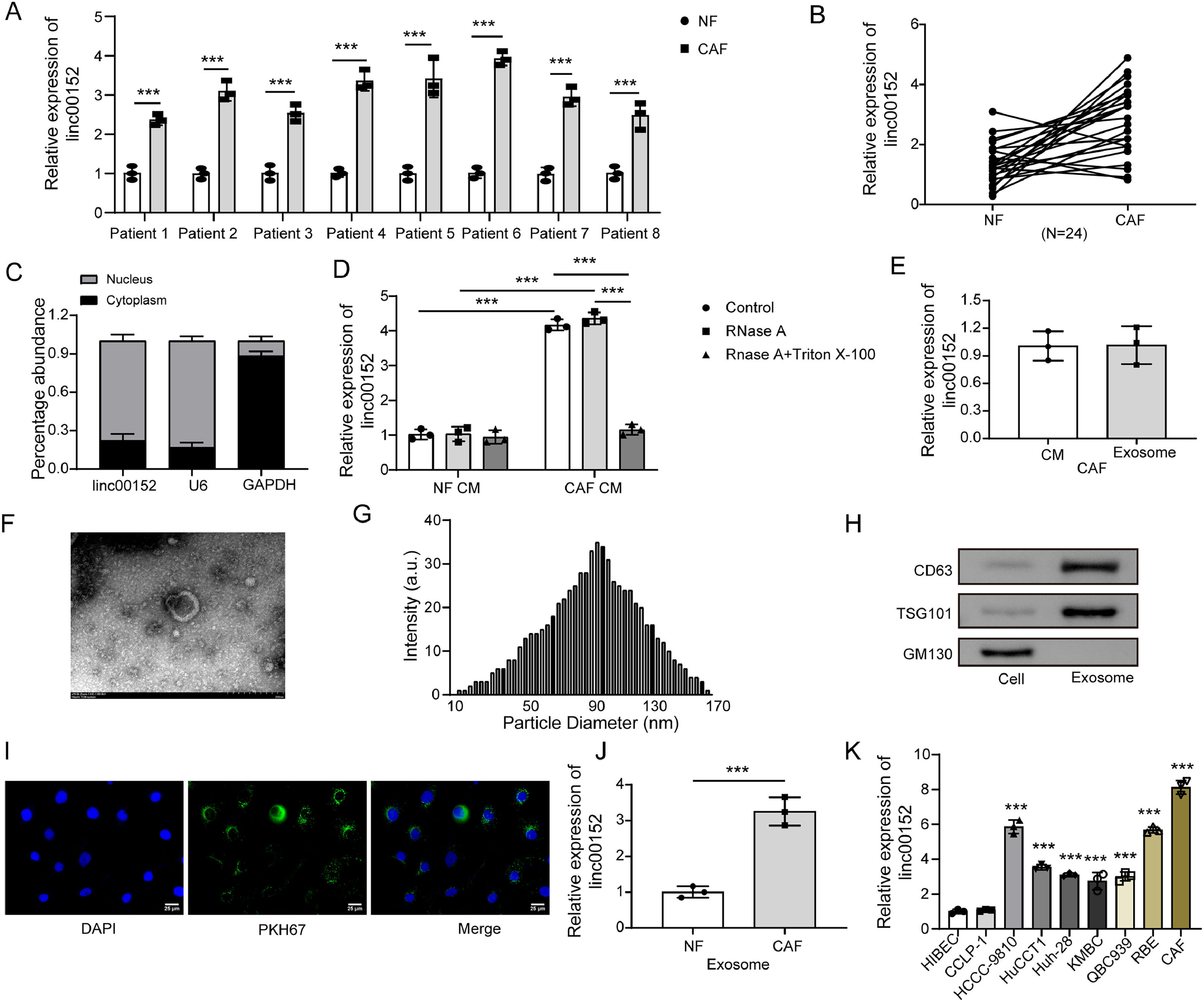 Exosomal linc00152 intensifies the crosstalk between cholangiocarcinoma ...