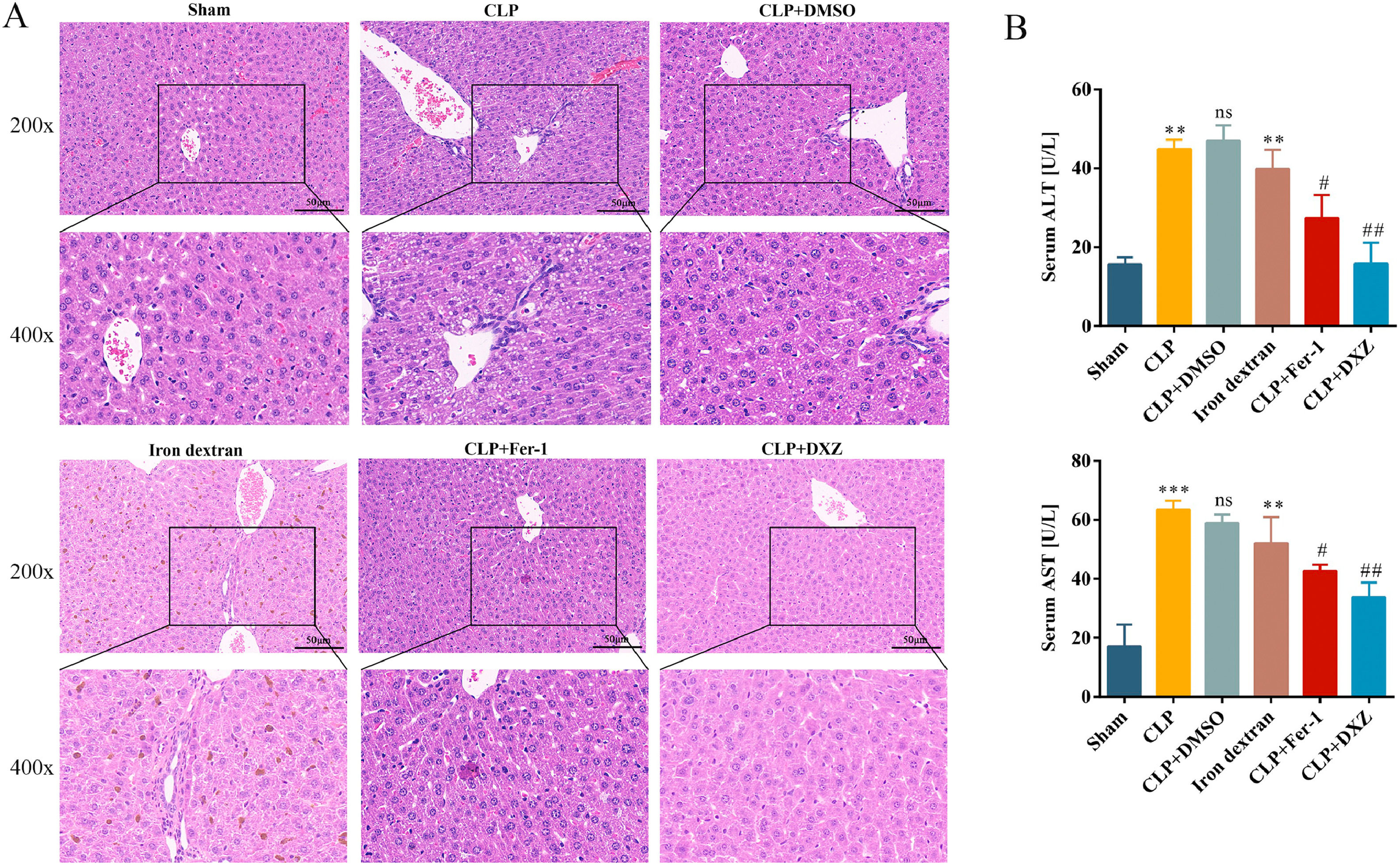 Lipocalin-2 silencing alleviates sepsis-induced liver injury through ...