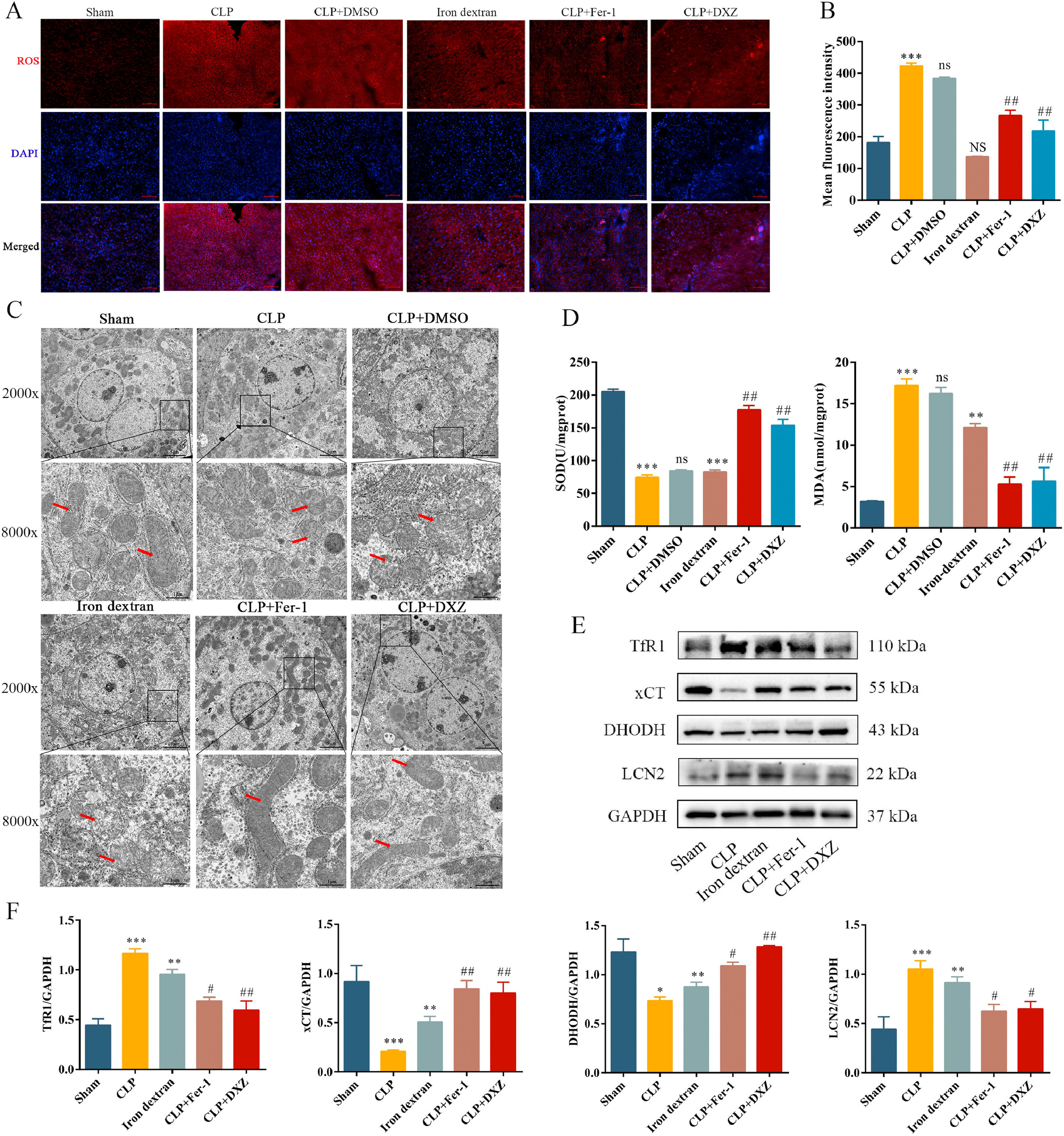 Lipocalin-2 silencing alleviates sepsis-induced liver injury through ...