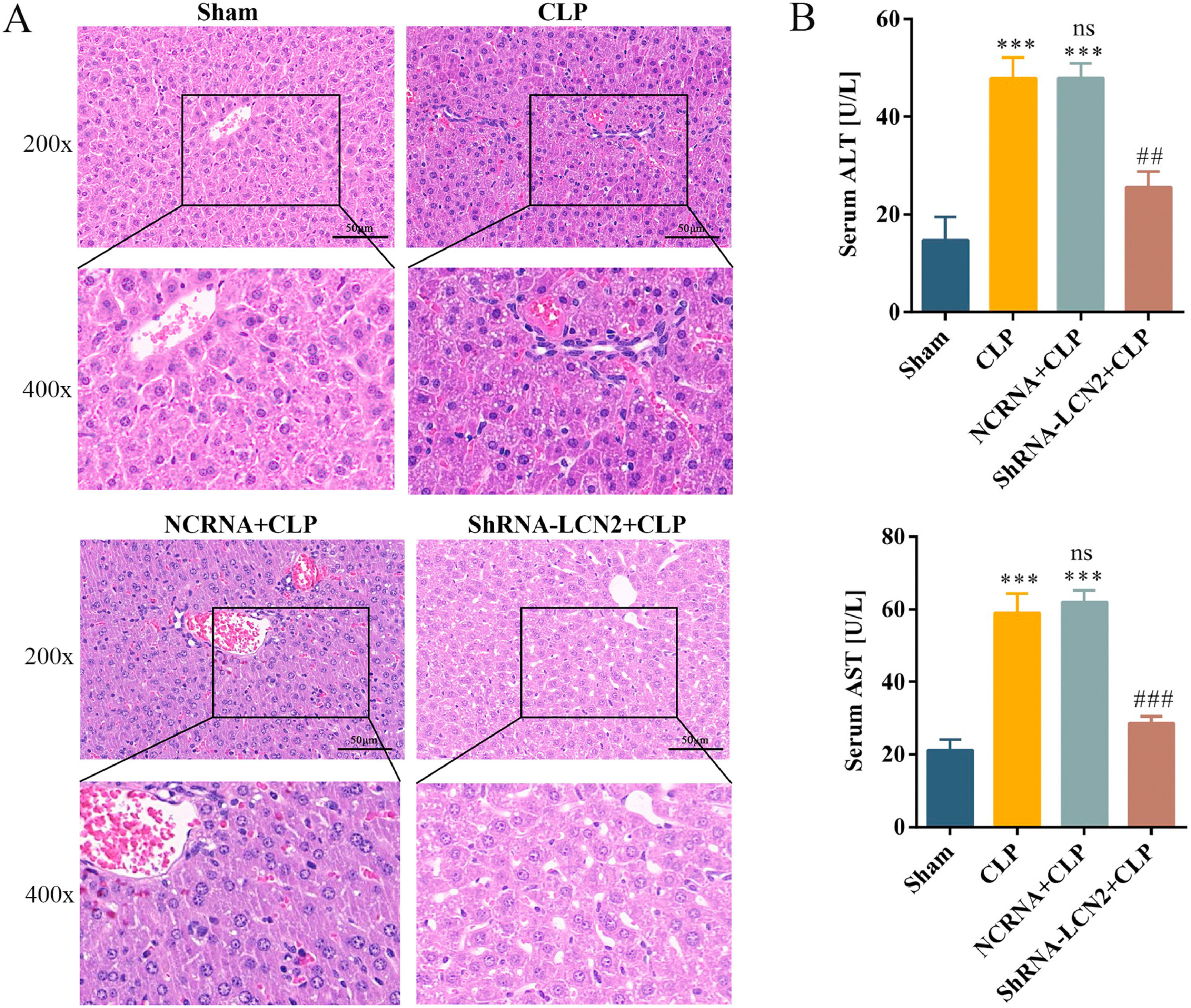 Lipocalin-2 silencing alleviates sepsis-induced liver injury through ...