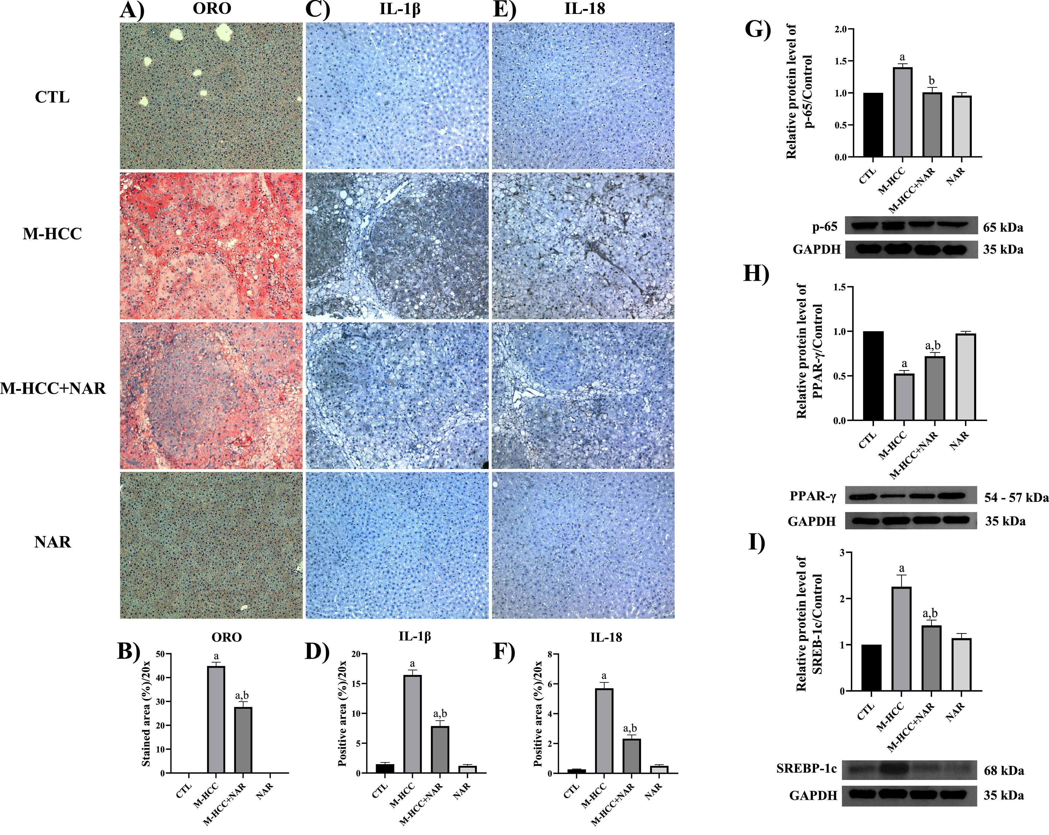 Naringenin attenuates early hepatocarcinogenesis induced by a MASH ...