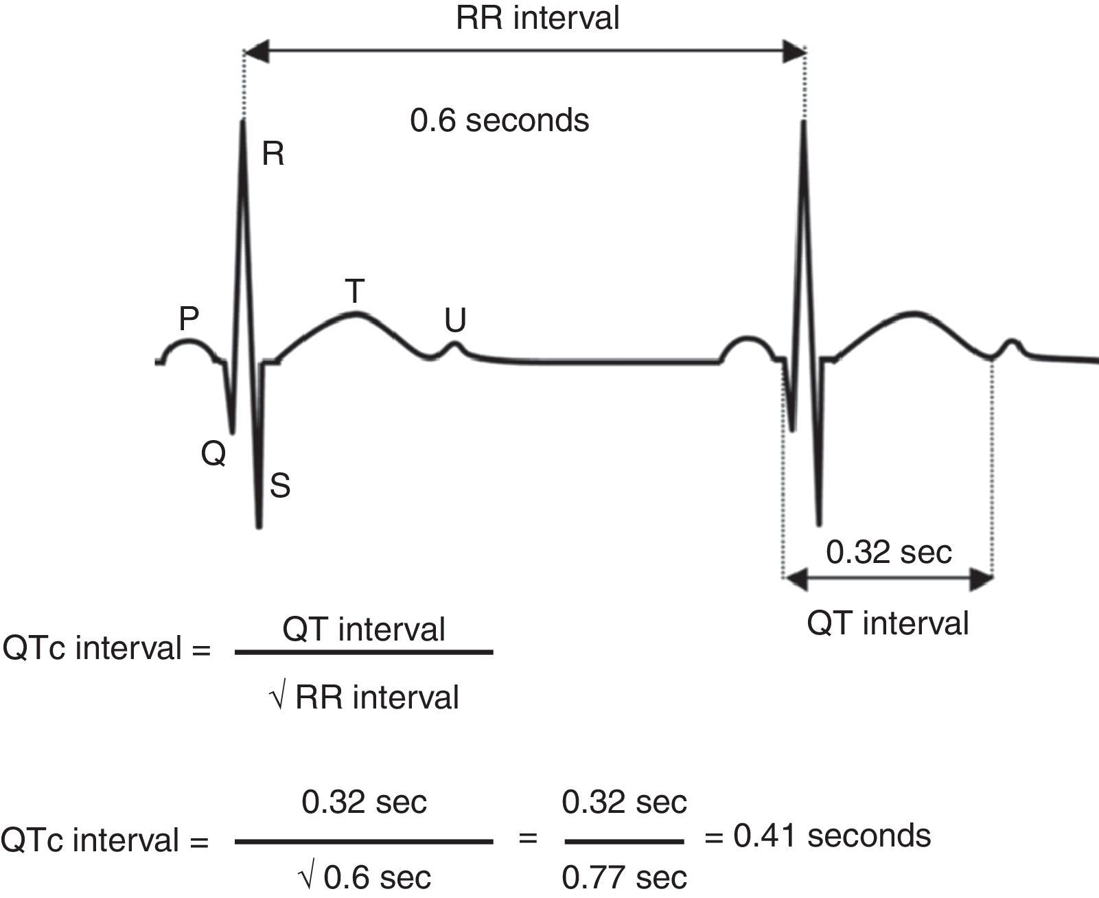 qtc normal range paediatric