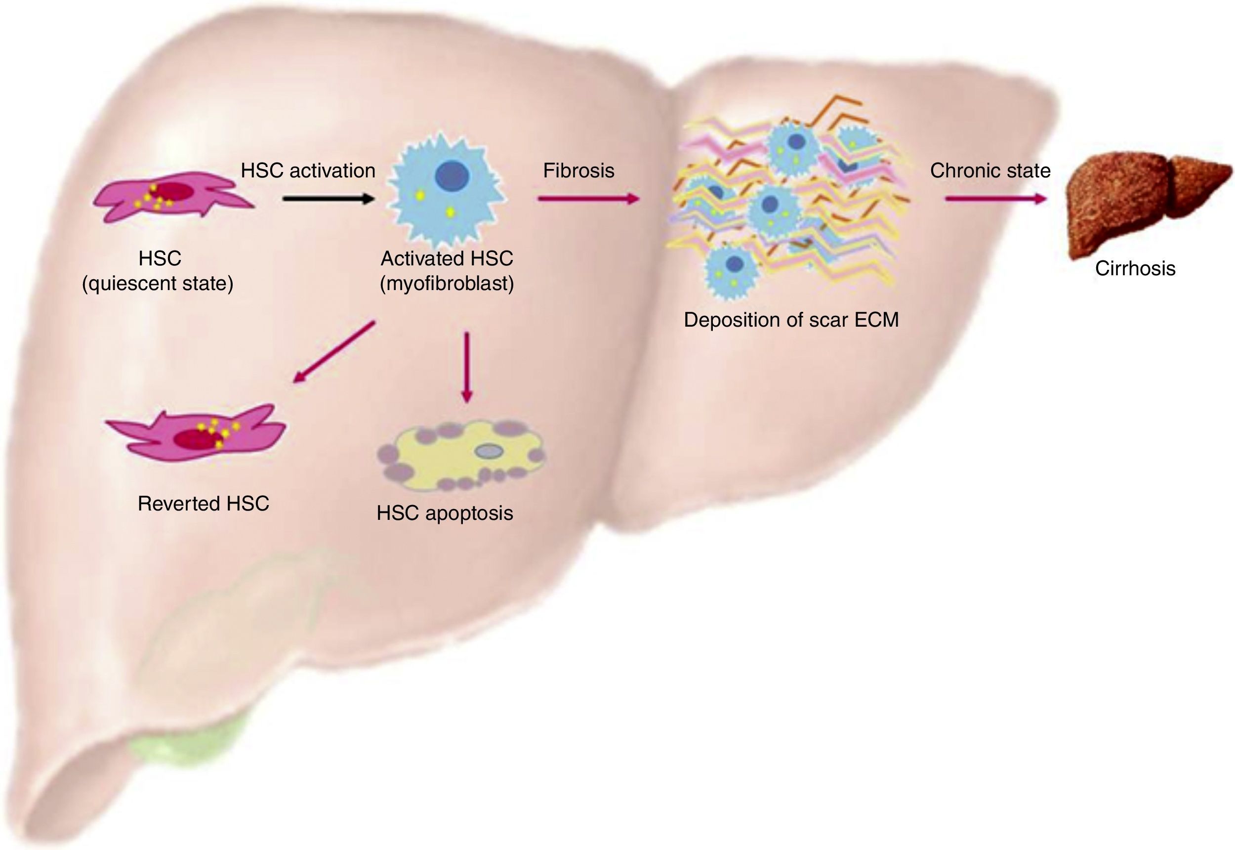 Mechanisms involved in liver damage resolution after hepatitis C virus ...