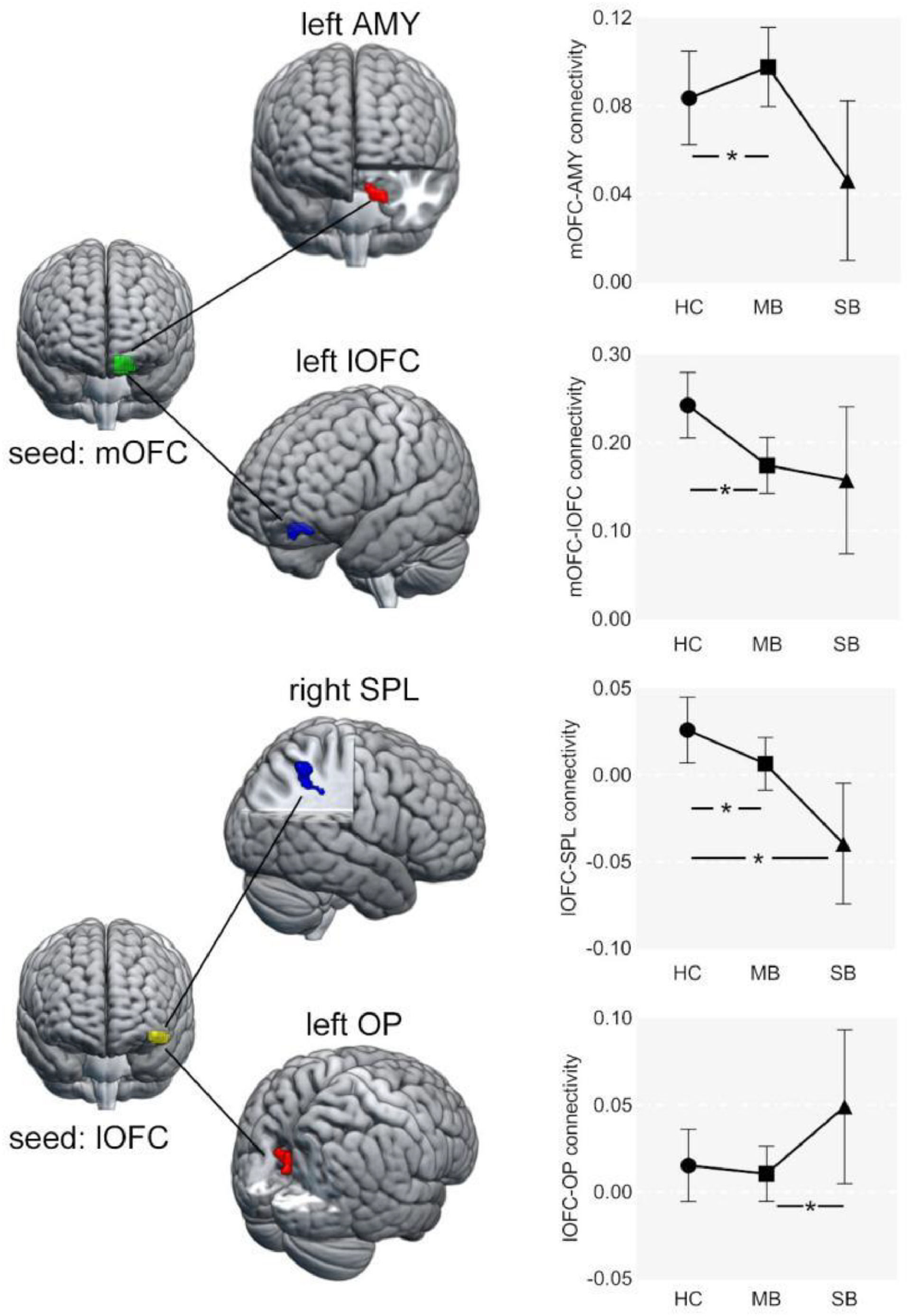Altered Connectivity Patterns Of Medial And Lateral Orbitofrontal