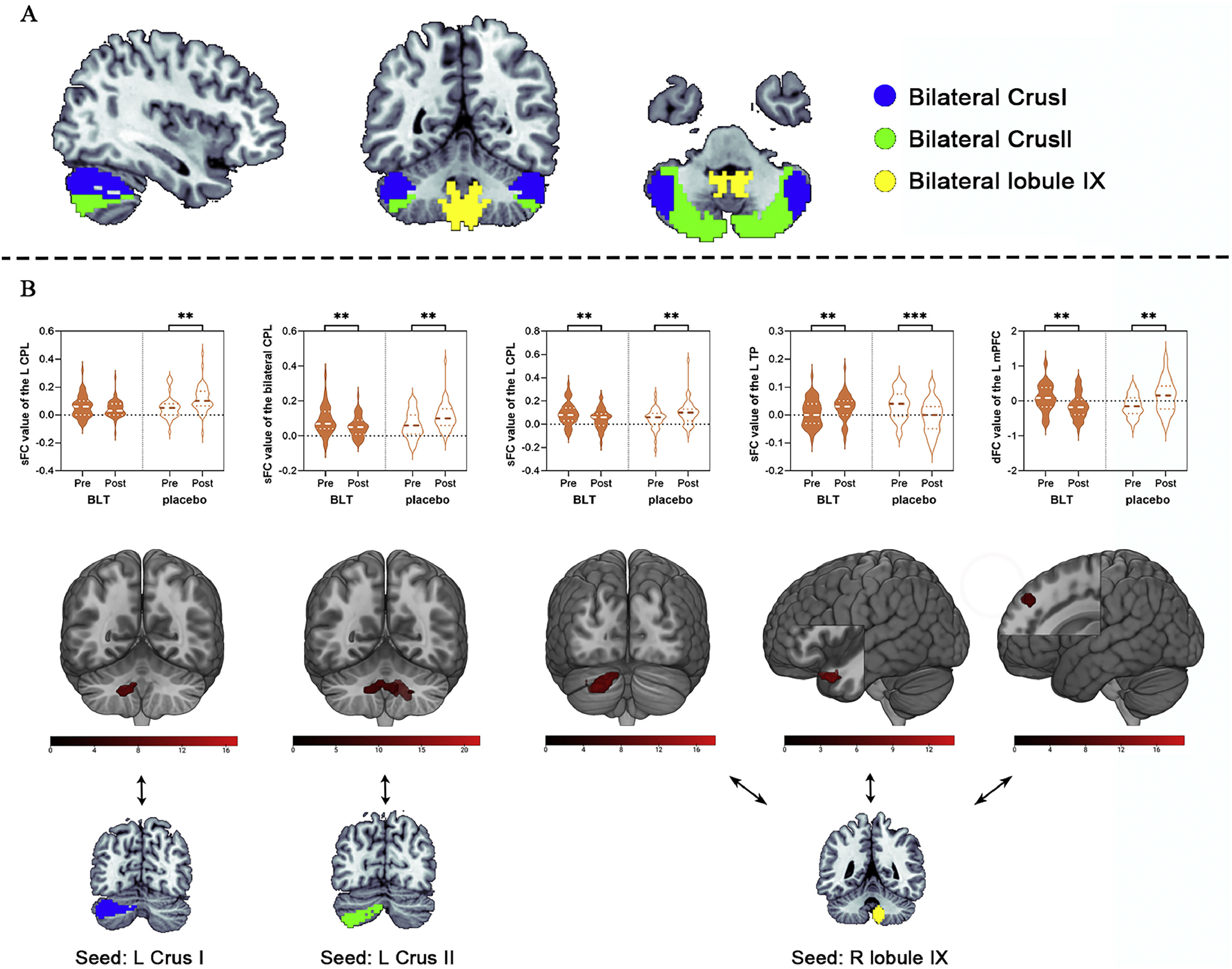 Bright light therapy-induced improvements of mood, cognitive functions ...
