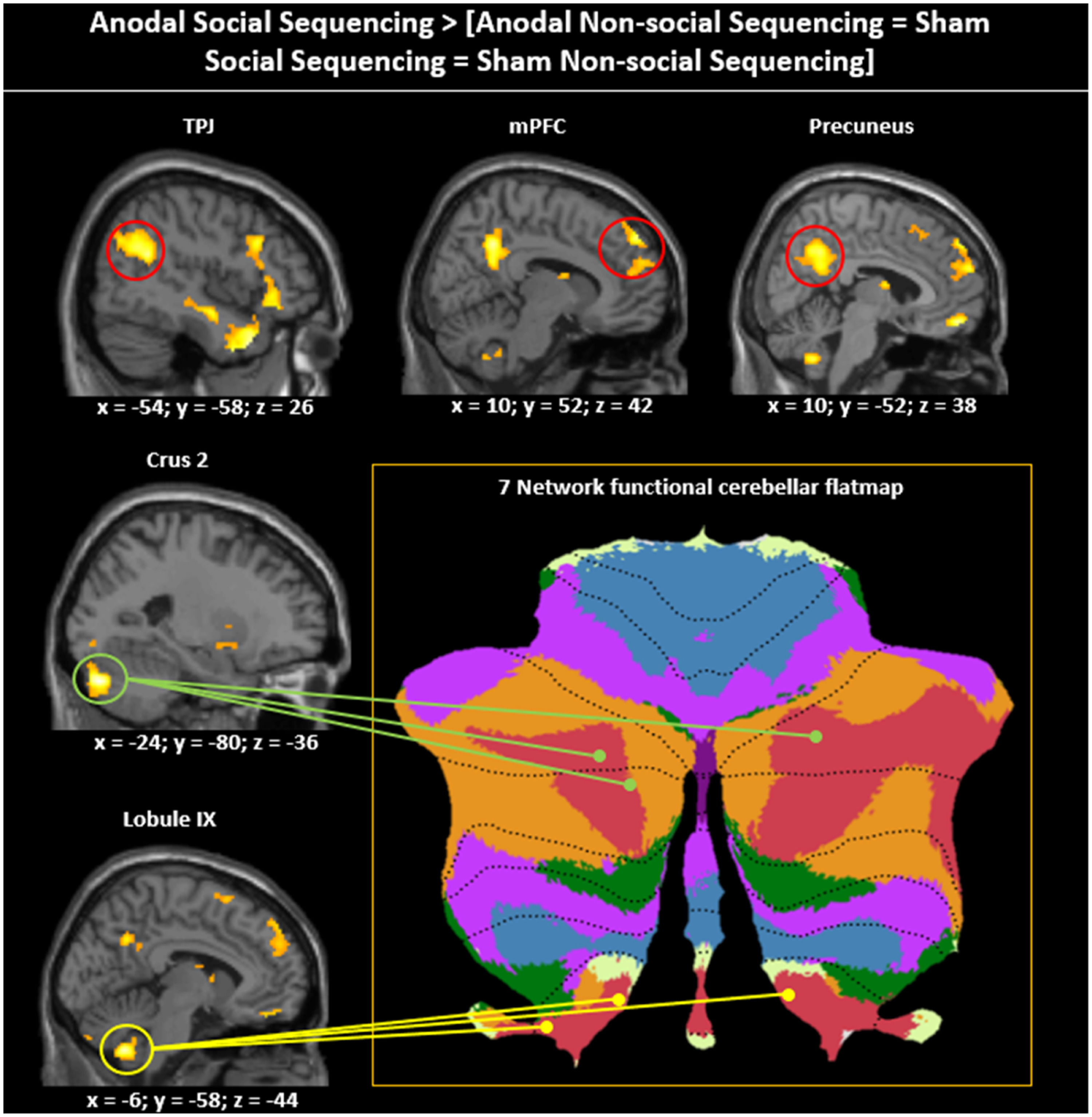 Exciting the social butterfly: Anodal cerebellar transcranial direct ...