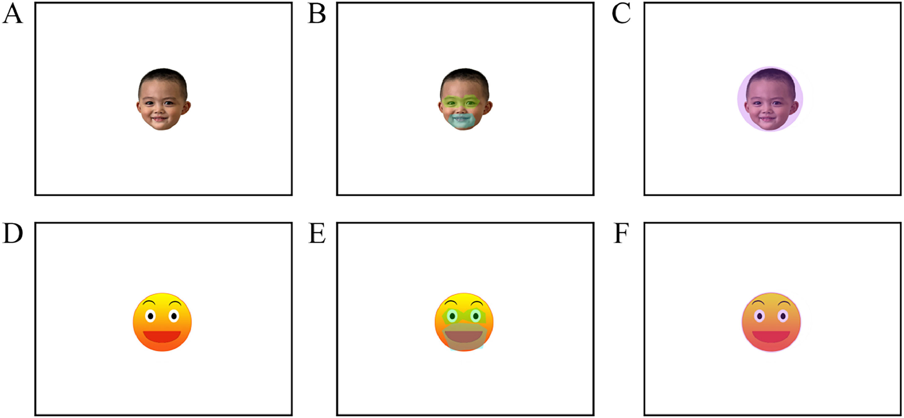 Neural and gaze pattern responses to happy faces in autism: Predictors ...