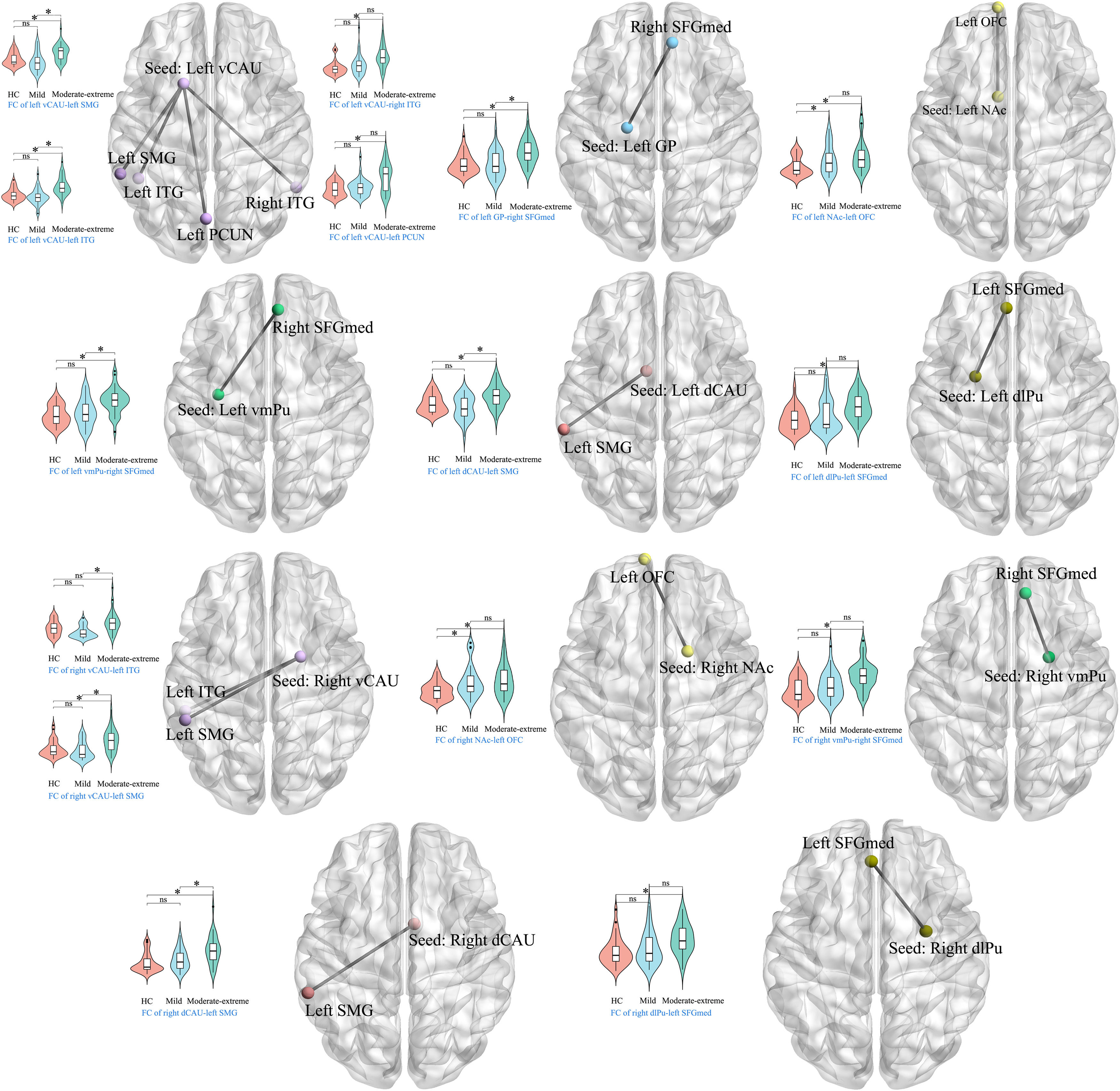Multimodal quantitative magnetic resonance imaging alterations of the ...
