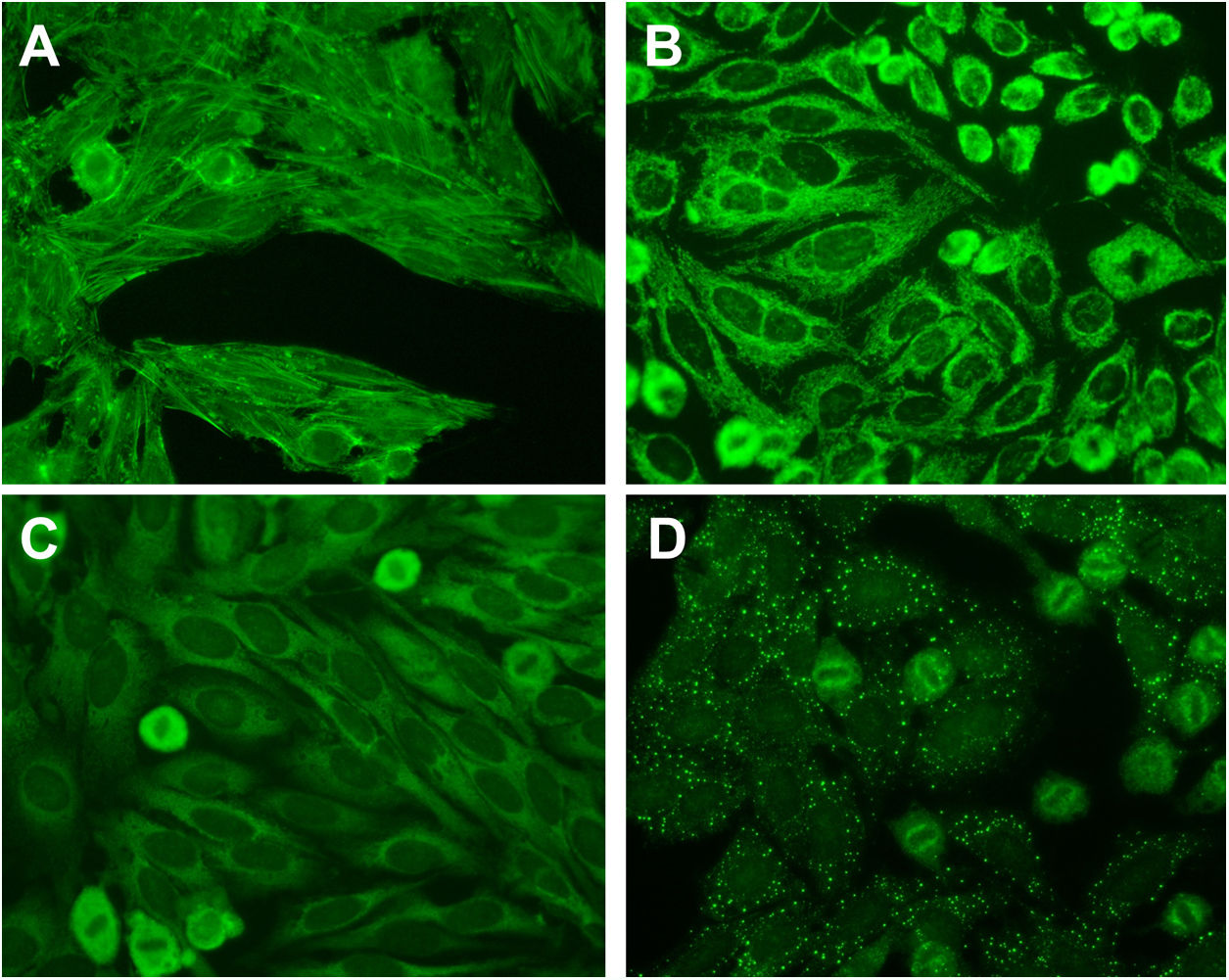 cytoplasmic mitochondrial like pattern