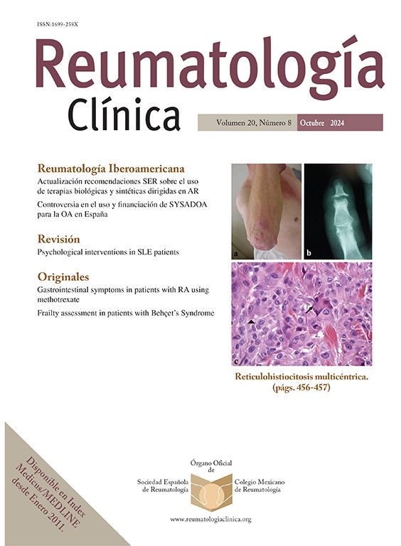 Lumbalgia inespecífica: en busca del origen del dolor | Reumatología ...