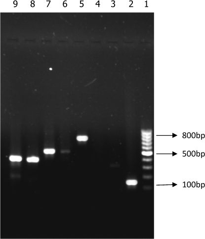 The prevalence of aminoglycoside-modifying enzyme genes (aac (6′)-I ...