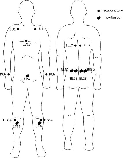 acupuncture back points