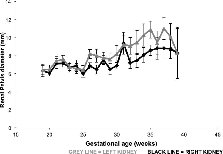 does pyelectasis go away