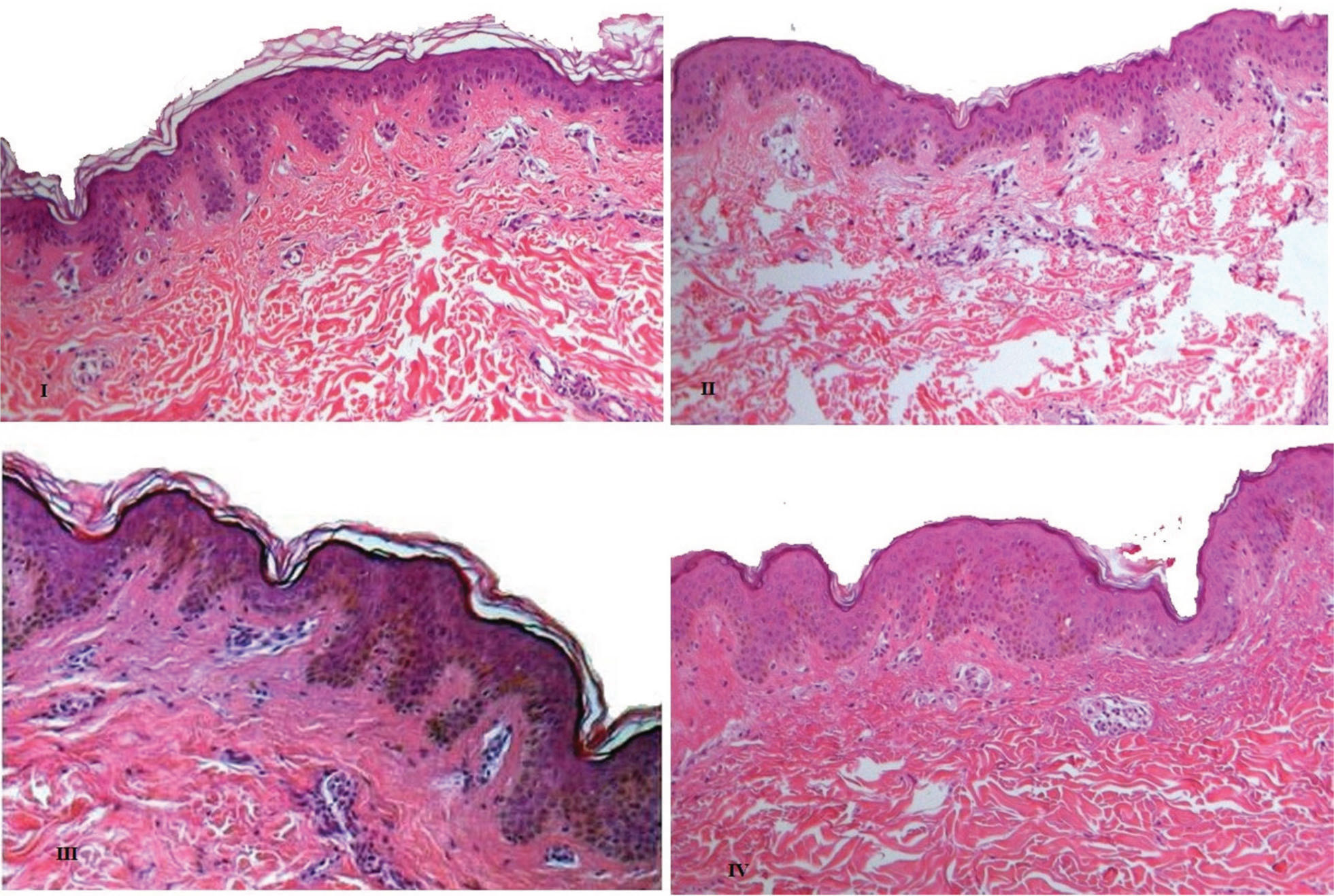 Histomorphometric analysis of the skin of women during the reproductive ...