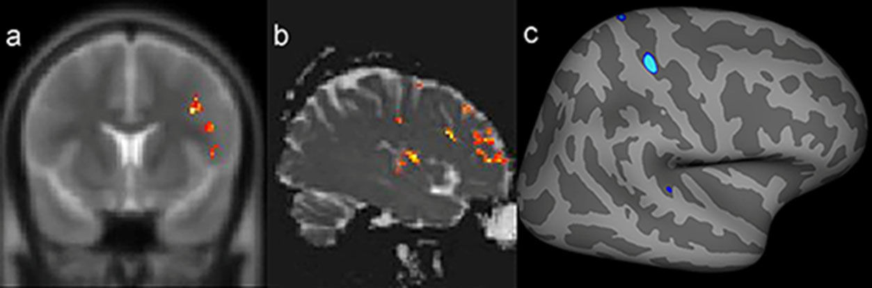 Multimodal quantitative magnetic resonance imaging analysis with ...