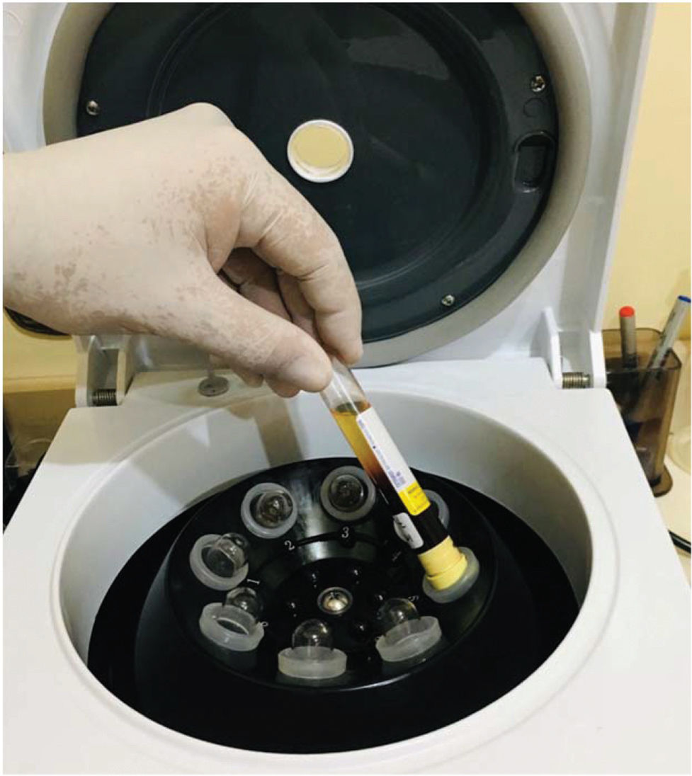 Turn down - turn up: a simple and low-cost protocol for preparing ...