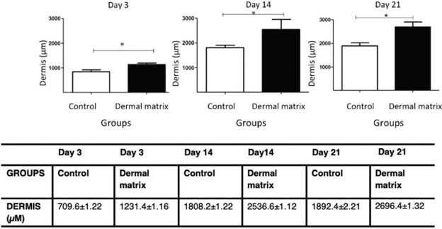 Acellular dermal matrix in skin wound healing in rabbits - histological ...